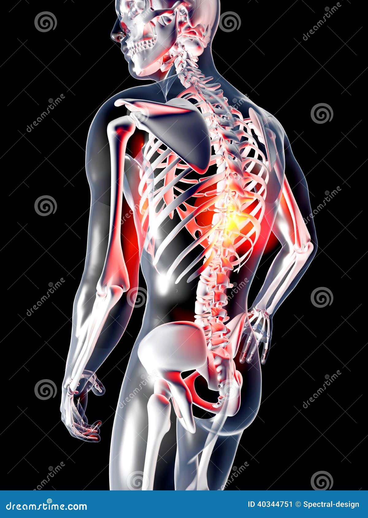 Anatomie - Rugpijn stock illustratie. Illustration of anatomie - 40344751