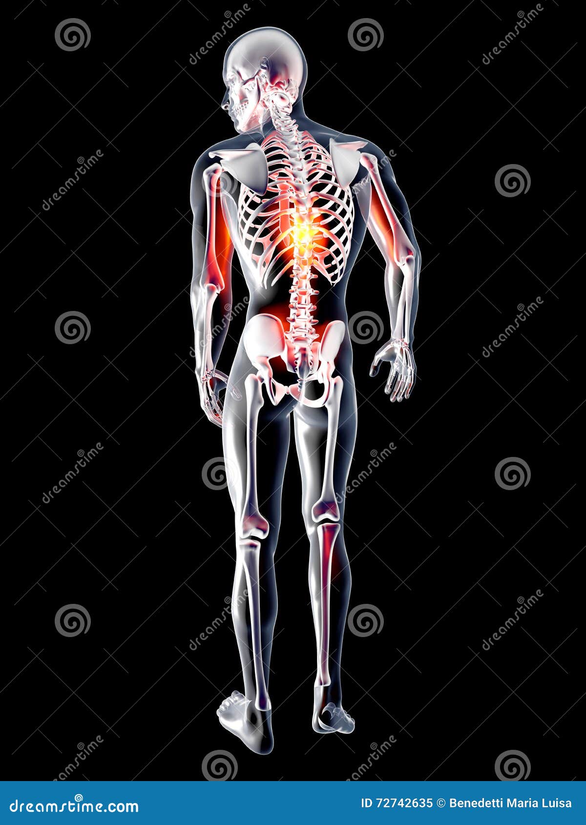 Anatomie - Rugpijn stock illustratie. Illustration of medisch - 72742635