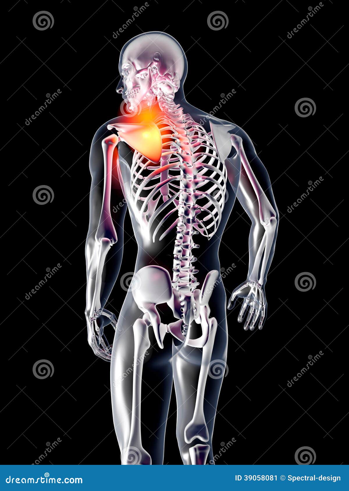 Anatomie - Verletzung Der Schulter Stock Abbildung - Illustration von ...