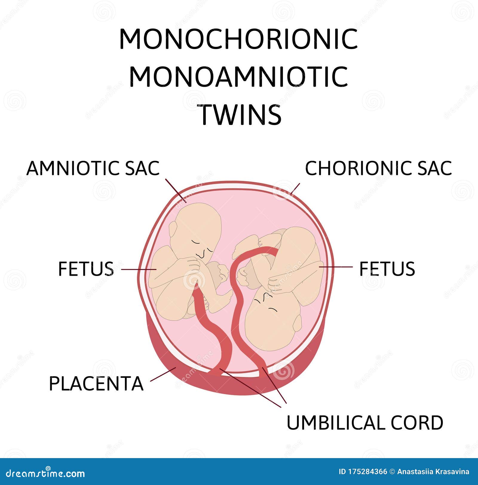Anatomy Of Abdomen With Twins Twin Types Infographic Elements In Flat