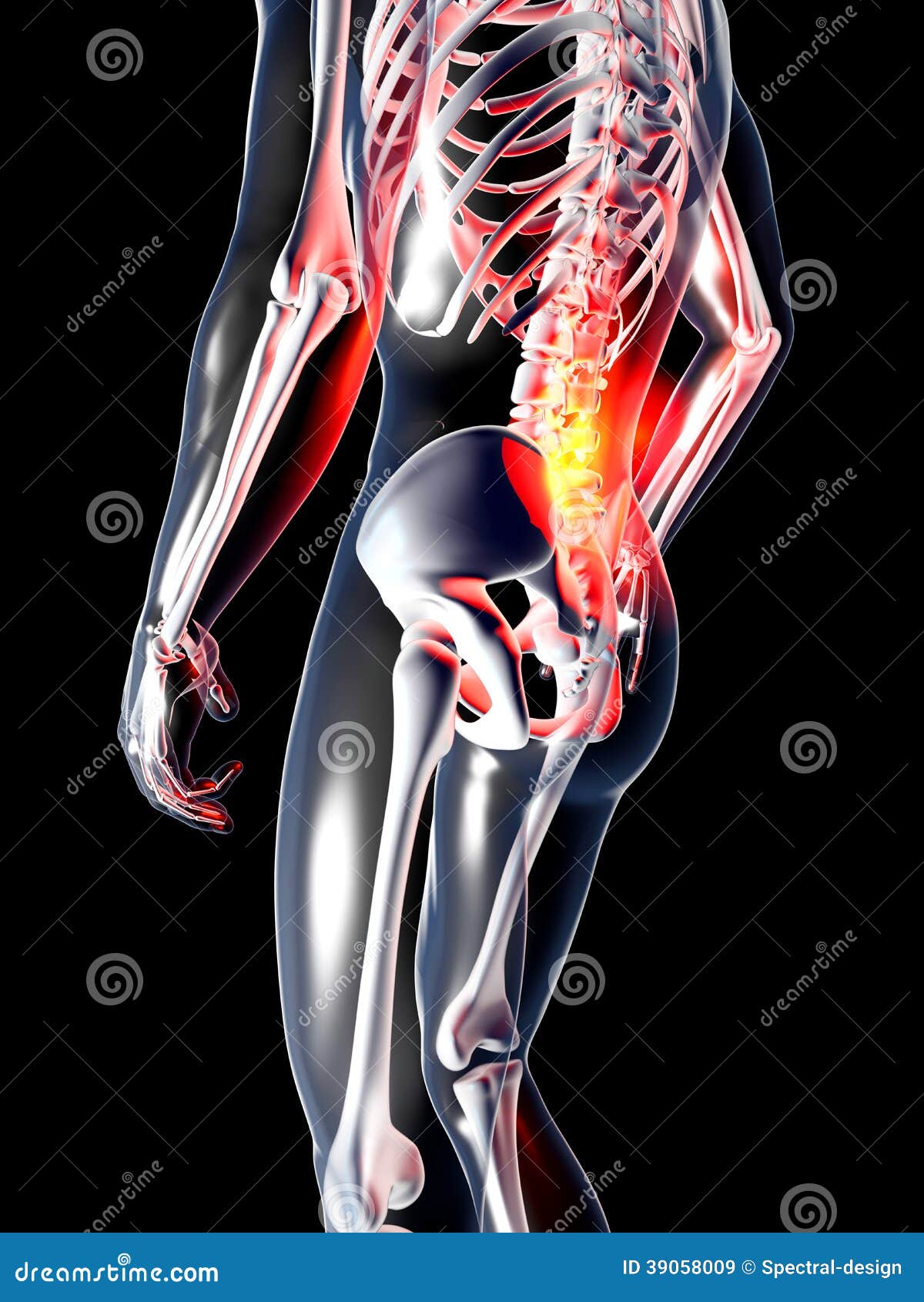 Anatomy - Back Pain stock illustration. Illustration of illness - 39058009