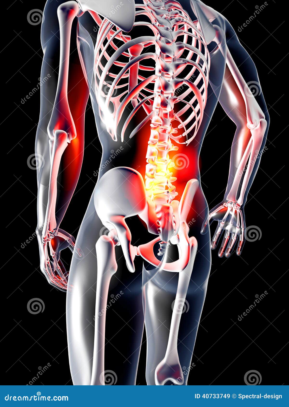 Anatomy - Back Pain stock illustration. Illustration of medical - 40733749