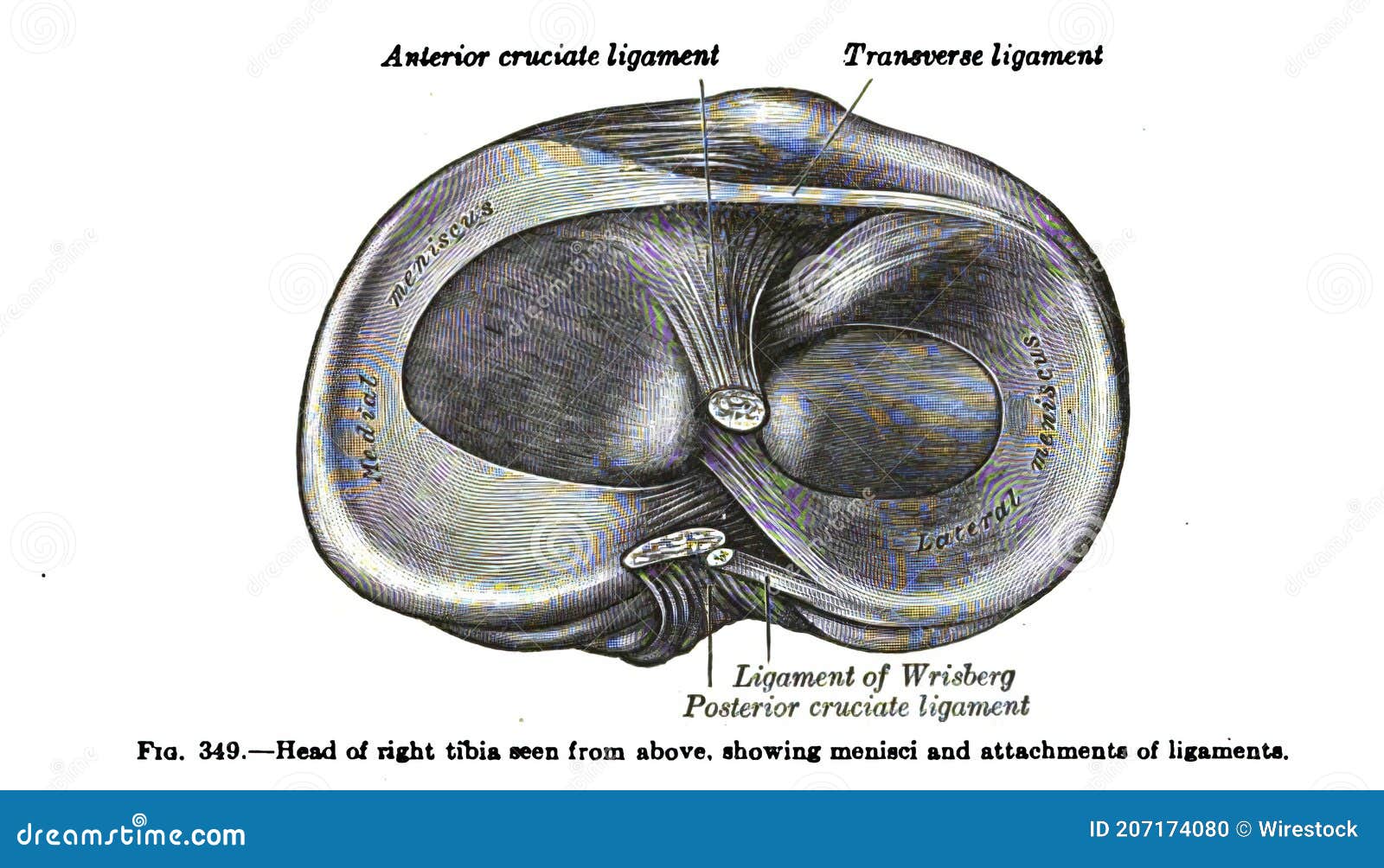 Anatomy Drawing and Text of the Head of the Right Tibia Seen from Above ...