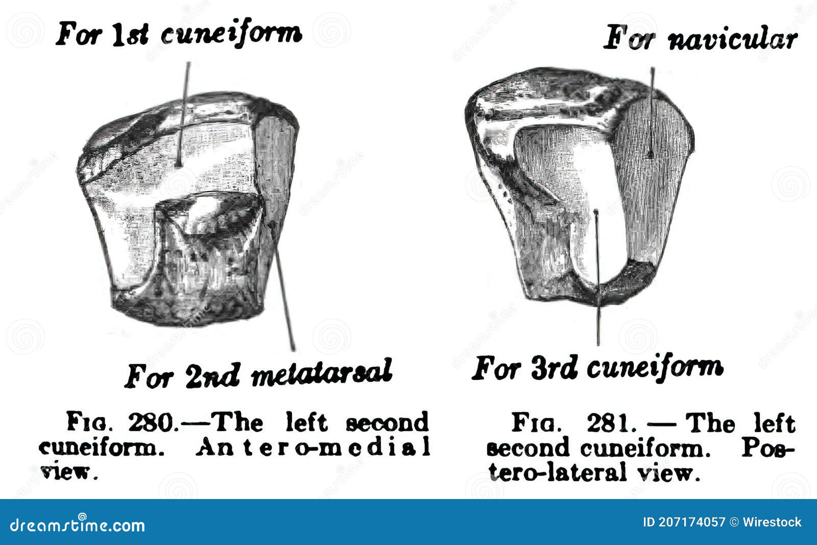 Anatomy Drawing and Text of the Left Second Cuneiform, from the 19th ...