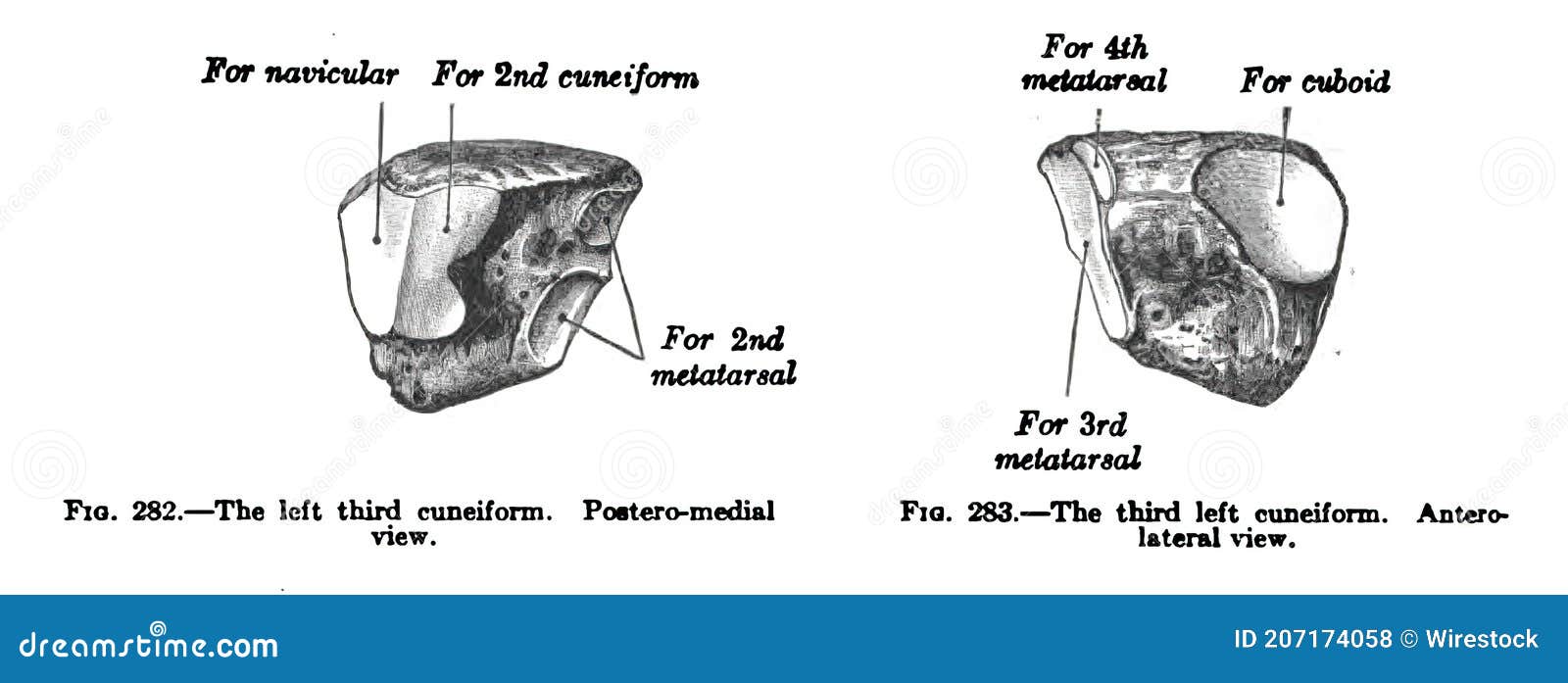 Anatomy Drawing and Text of the Left Third Cuneiform, from the 19th ...