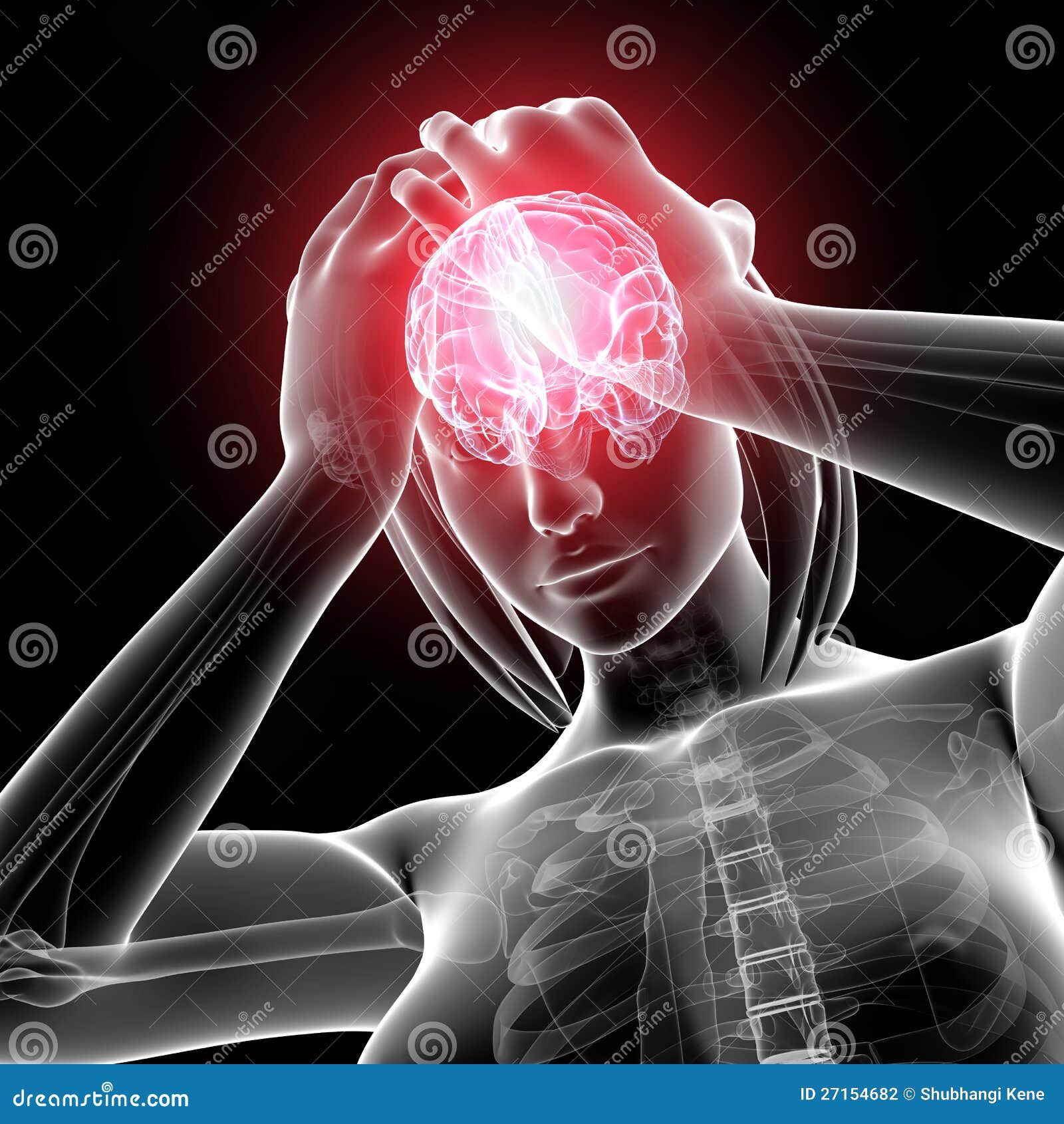 Anatomy of head pain stock illustration. Illustration of medicine ...