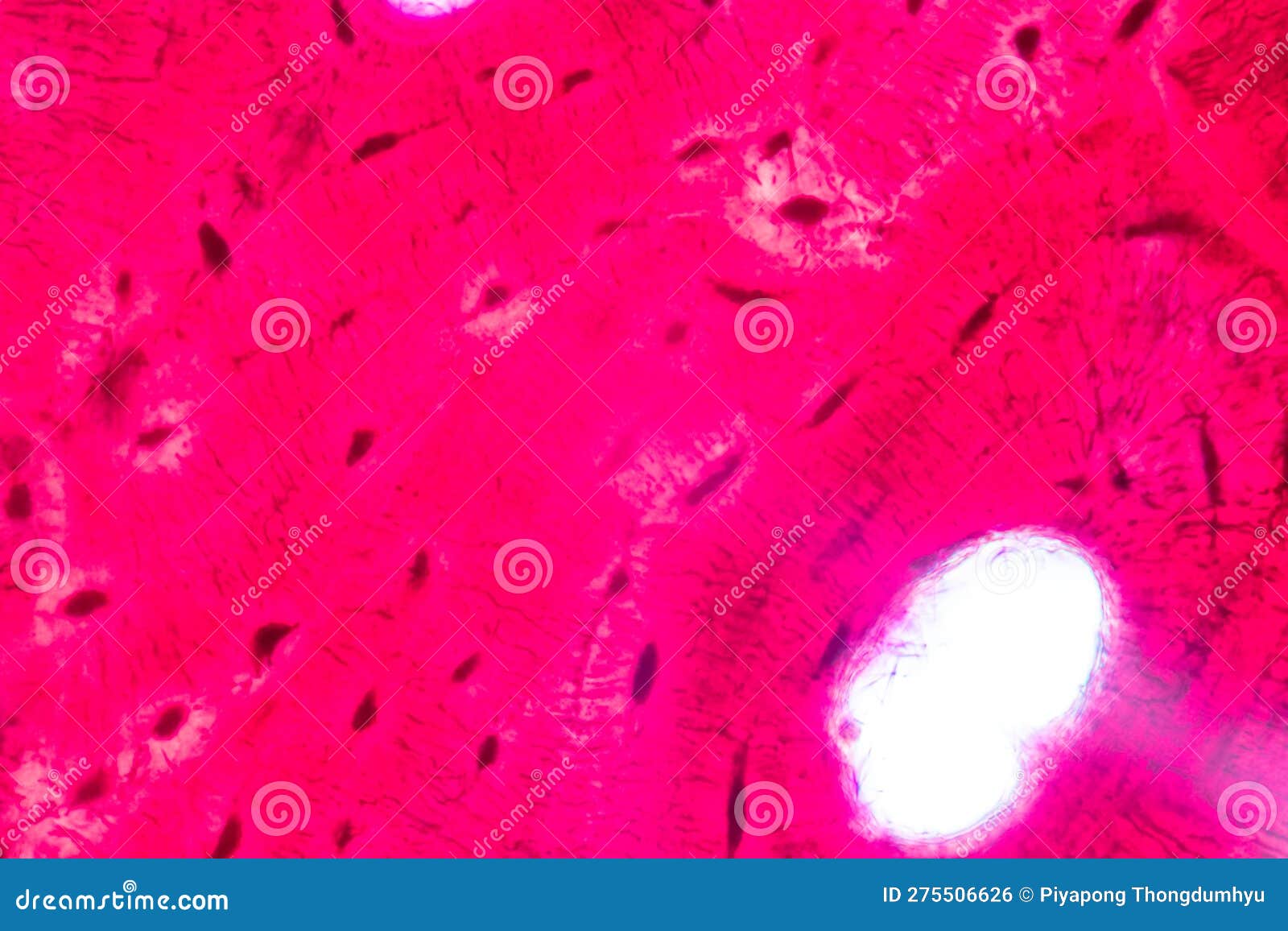 Histological Bone, Elastic Cartilage Human and Joint of Human Foetus ...