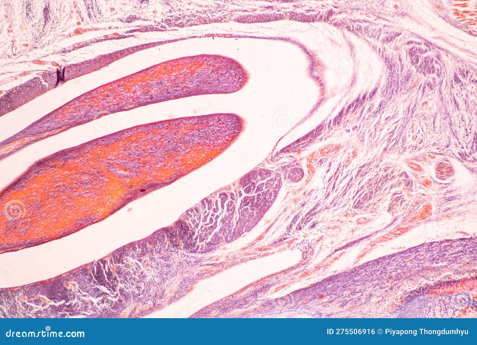 Histological Bone, Elastic Cartilage Human and Joint of Human Foetus ...