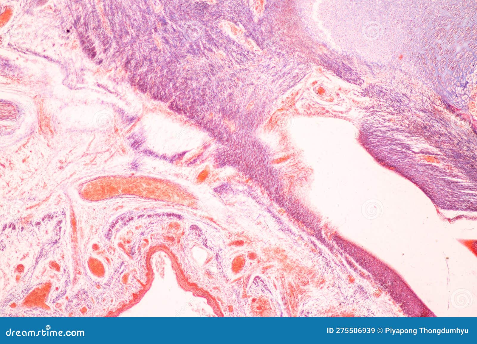 Histological Bone, Elastic Cartilage Human and Joint of Human Foetus ...