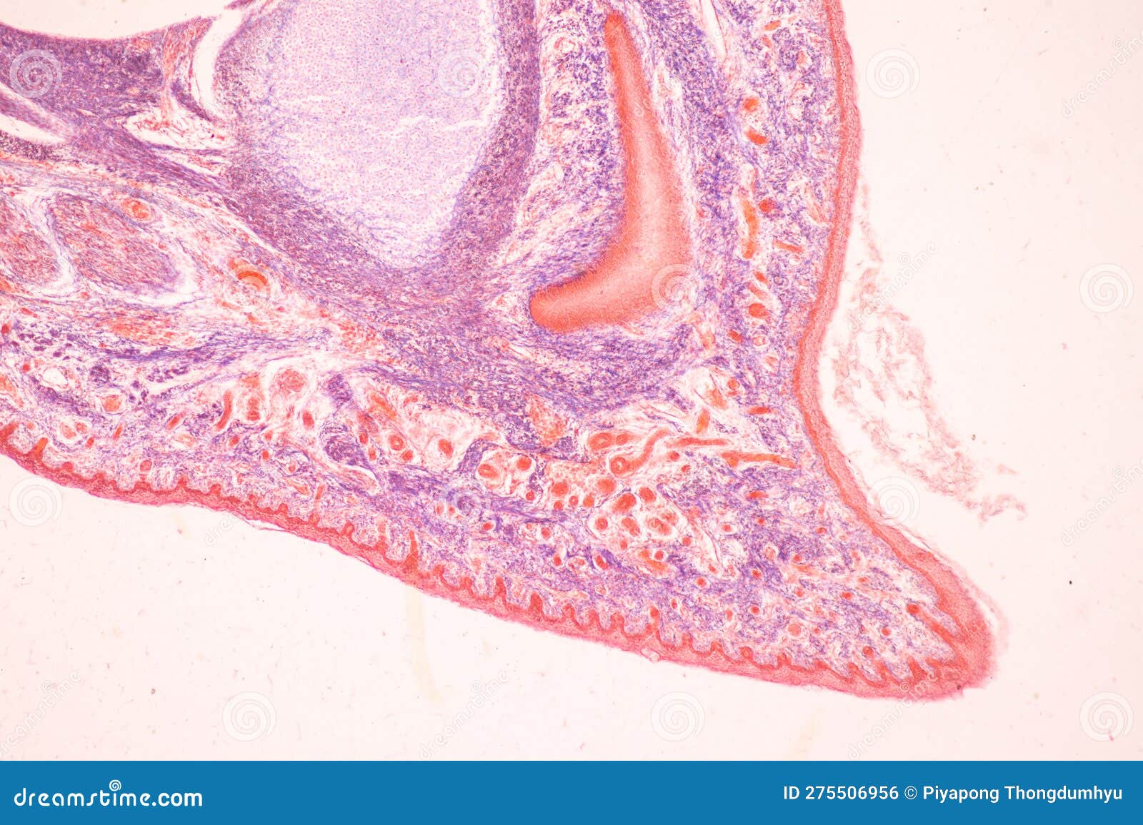 Histological Bone, Elastic Cartilage Human and Joint of Human Foetus ...
