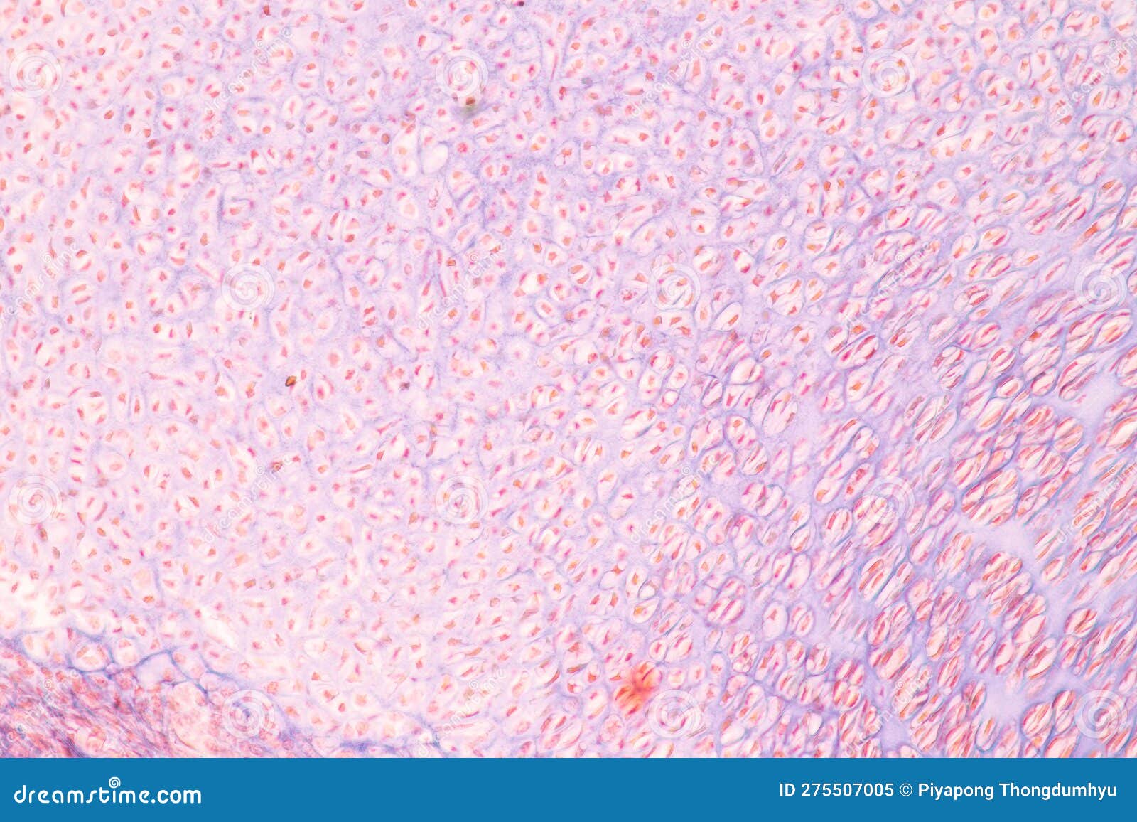 Histological Bone, Elastic Cartilage Human and Joint of Human Foetus ...