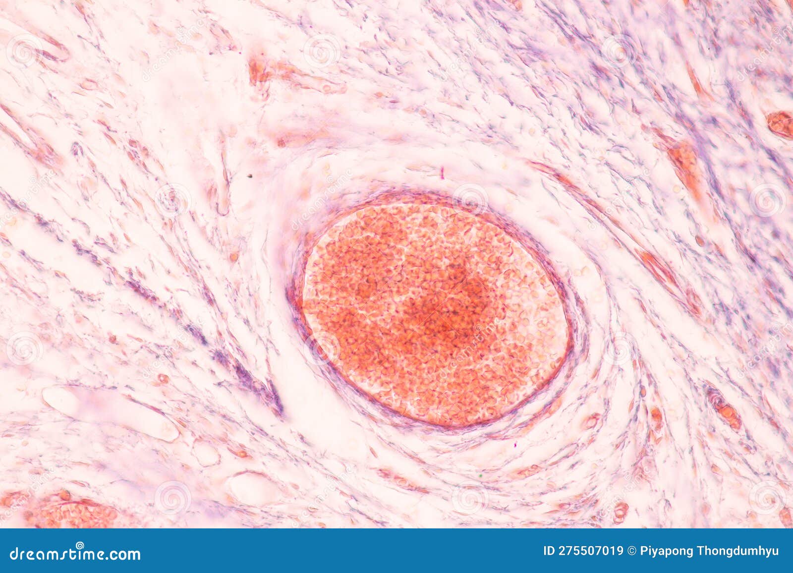 Histological Bone, Elastic Cartilage Human and Joint of Human Foetus ...