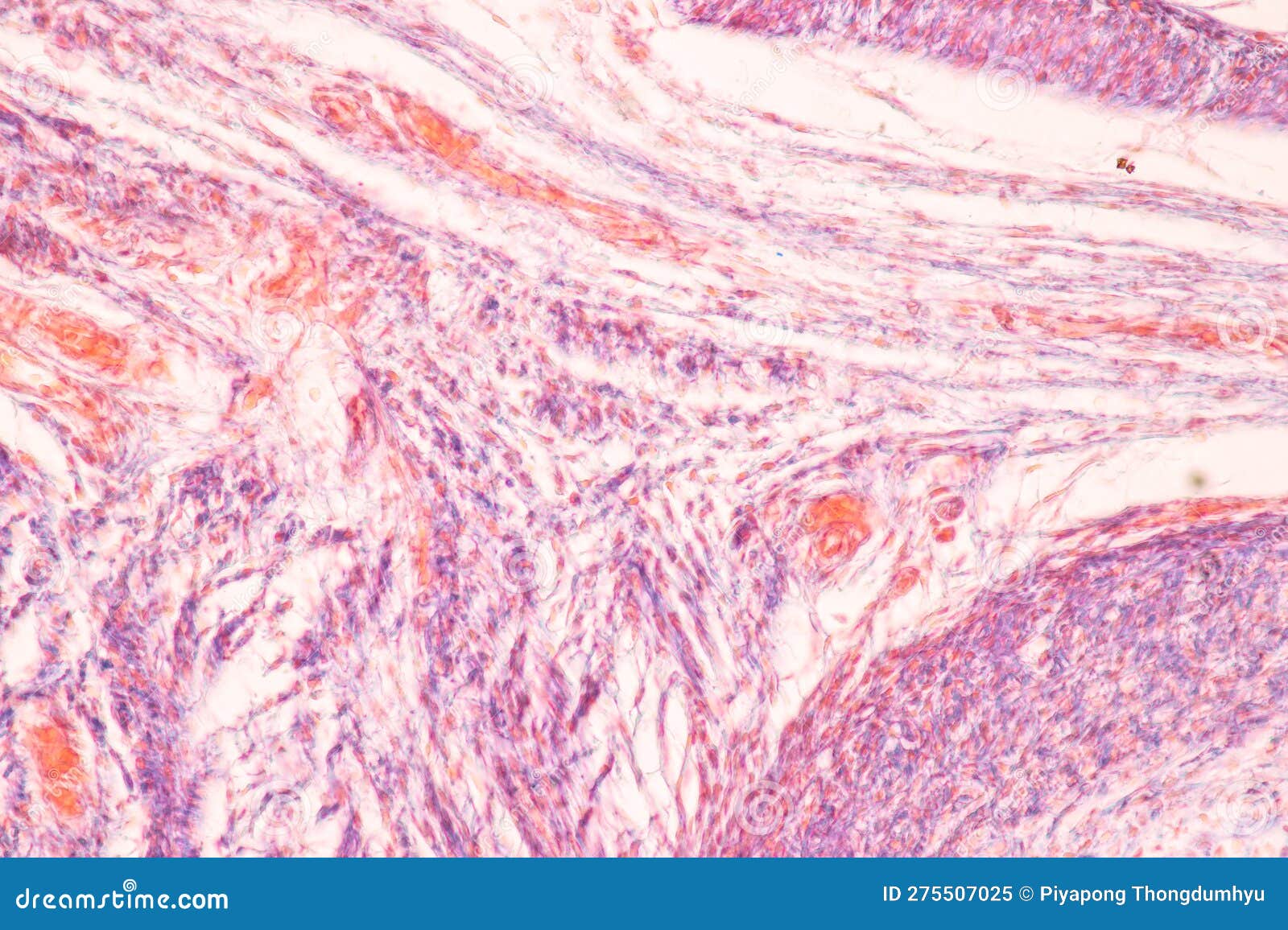 Histological Bone, Elastic Cartilage Human and Joint of Human Foetus ...
