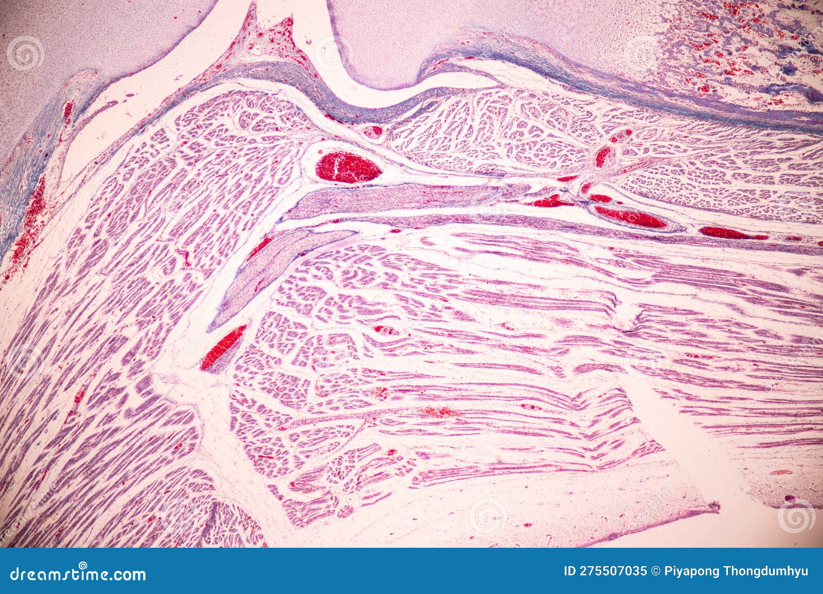 Histological Bone, Elastic Cartilage Human and Joint of Human Foetus ...