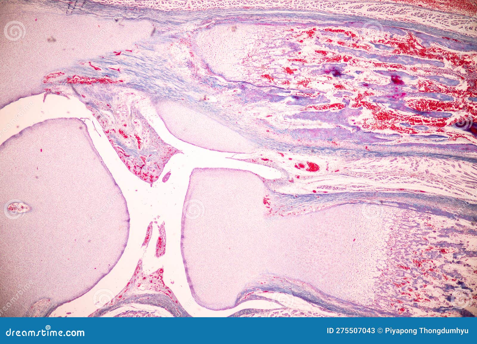X-ray Of The Human Joint And Bones. X-ray Of A Leg Close Up Royalty ...