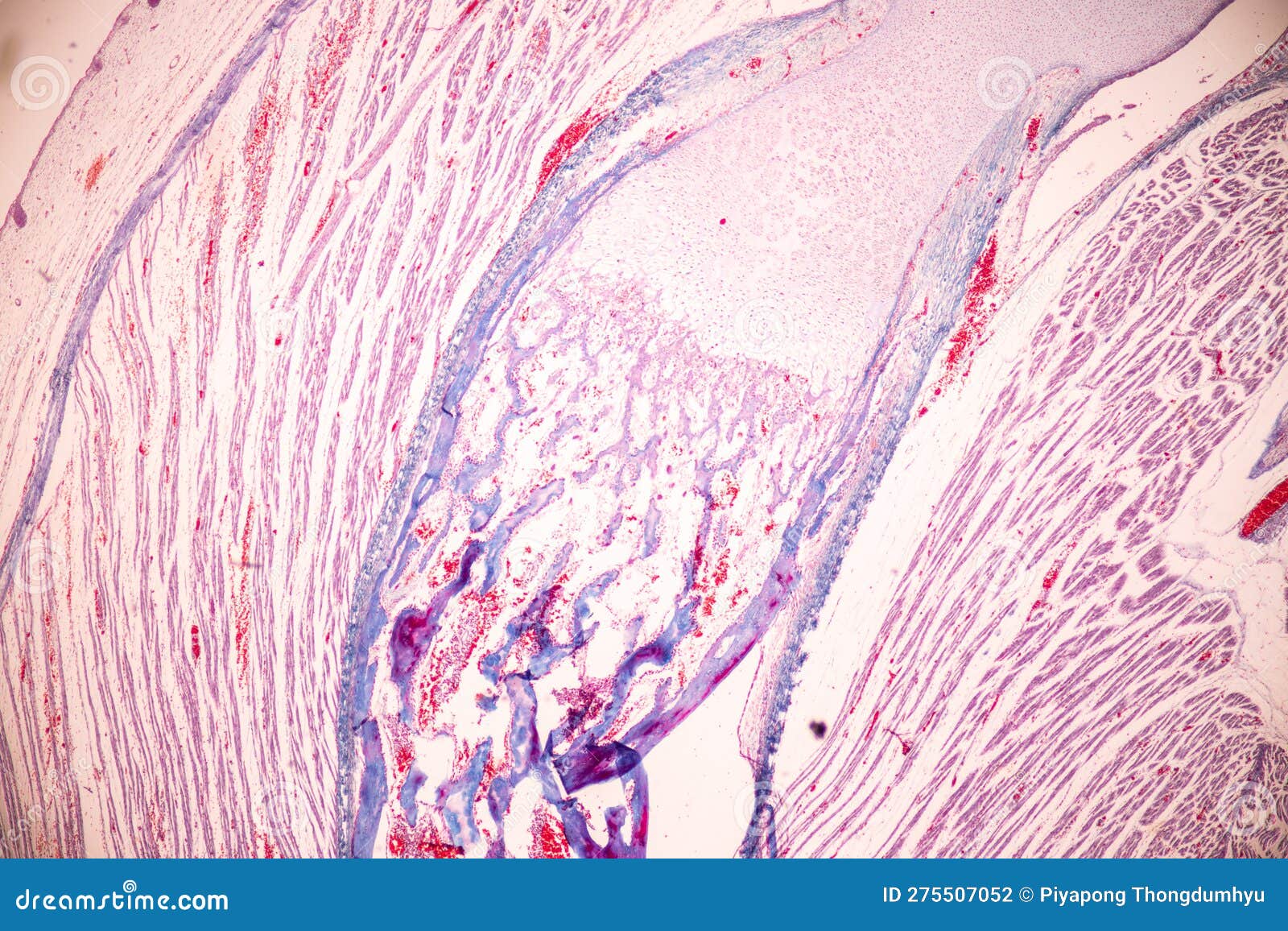 Elastic Cartilage Slide Labeled