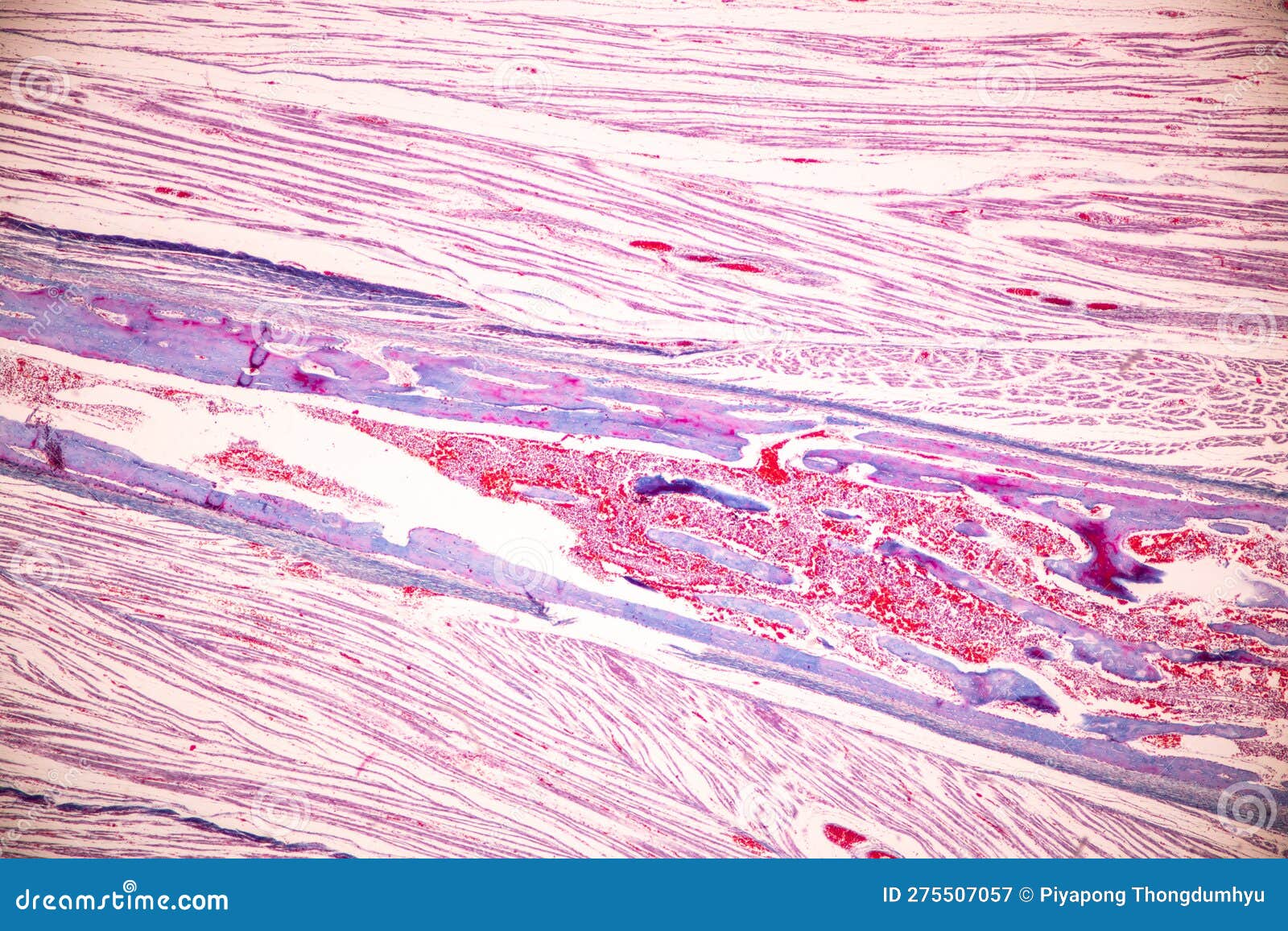 Histological Bone, Elastic Cartilage Human and Joint of Human Foetus ...