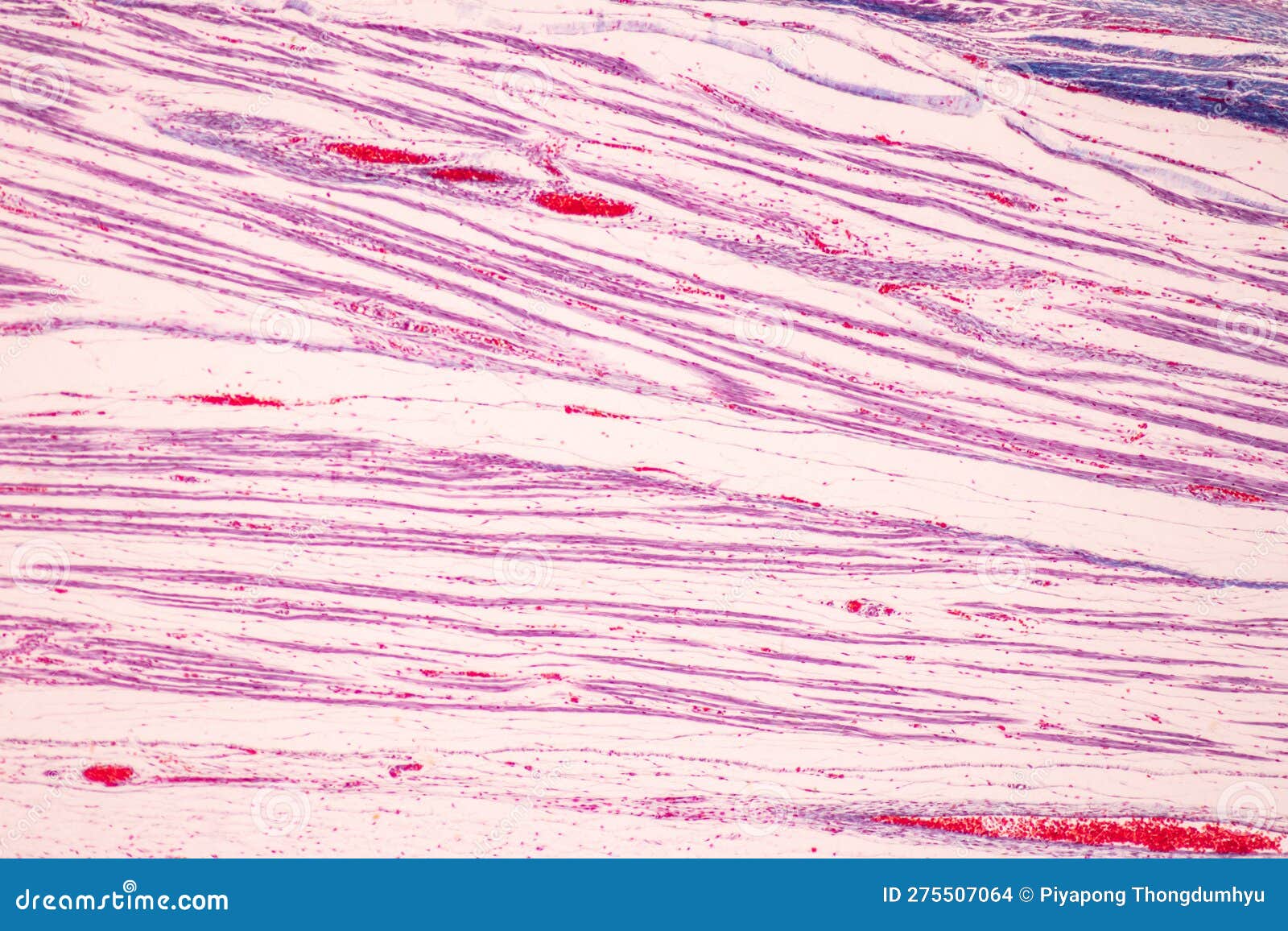 Histological Bone, Elastic Cartilage Human and Joint of Human Foetus ...