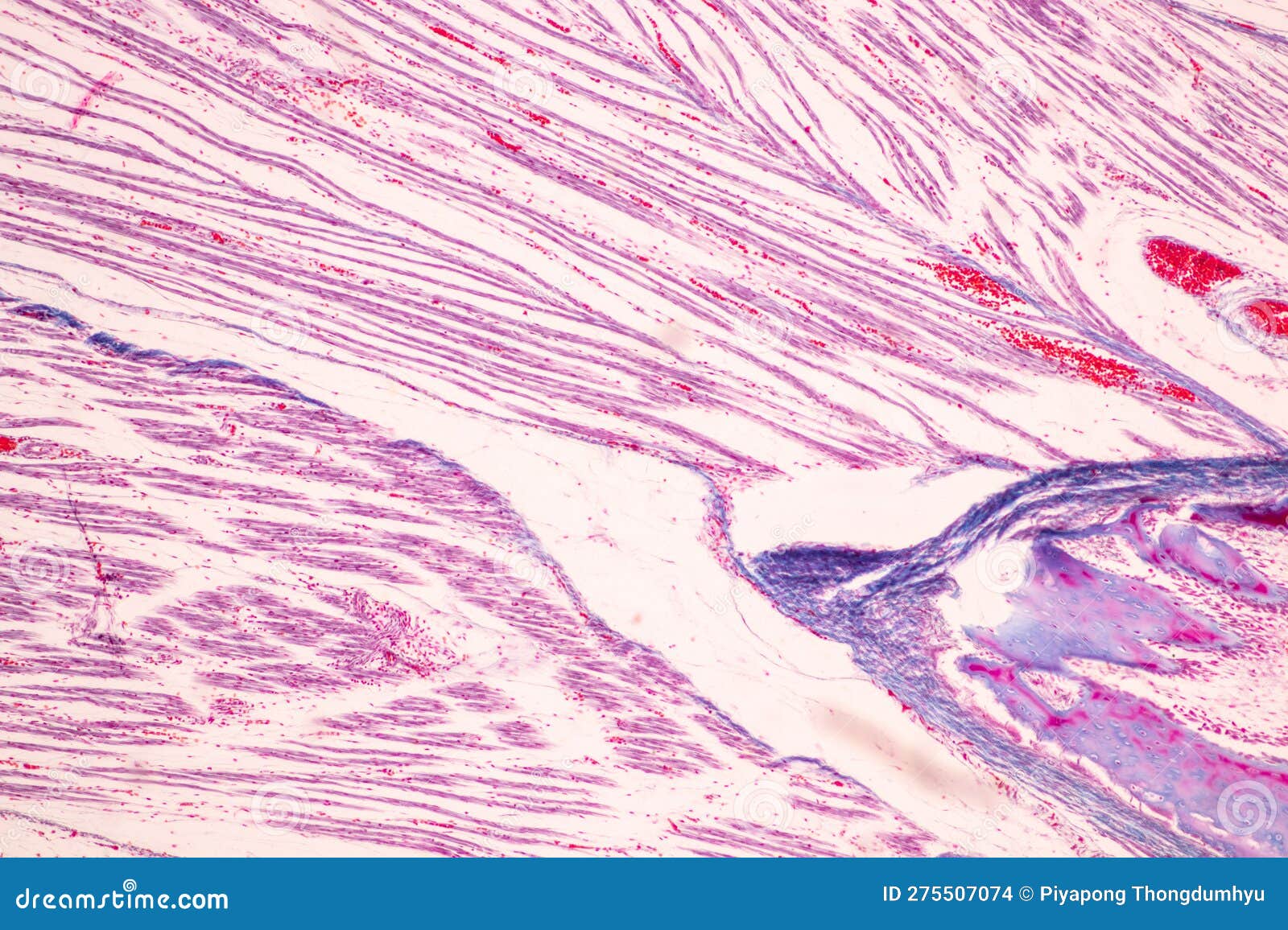 Histological Bone, Elastic Cartilage Human and Joint of Human Foetus ...