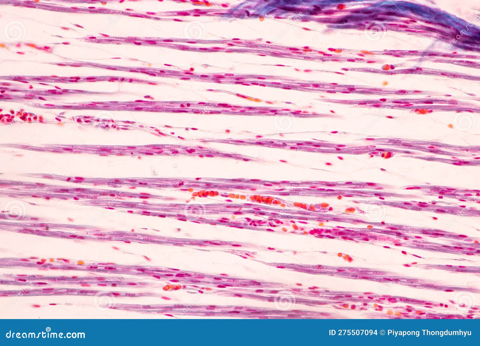 Histological Bone, Elastic Cartilage Human and Joint of Human Foetus ...