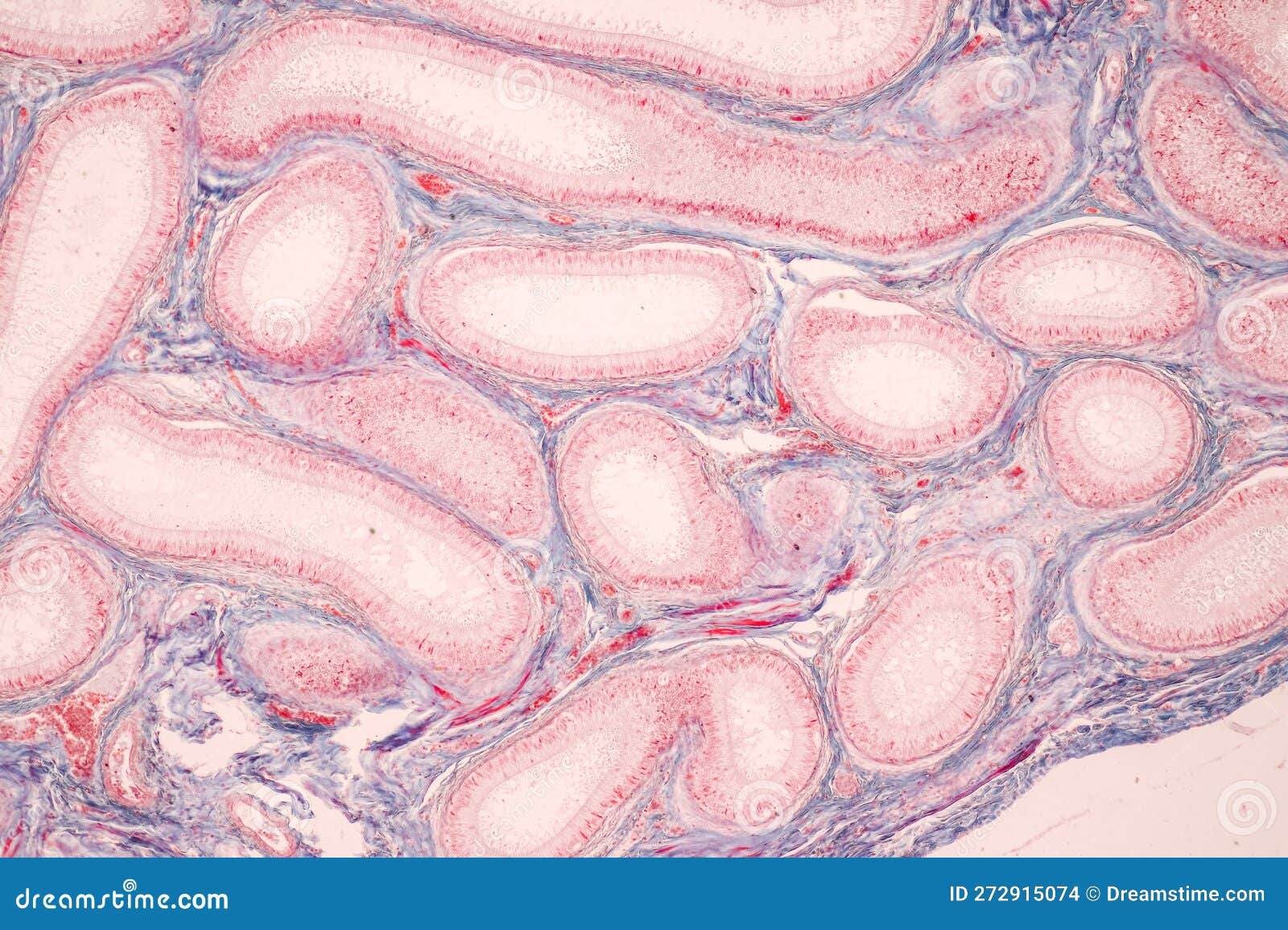 Histological Epididymis and Testis Human Cells Under Microscope. Stock ...