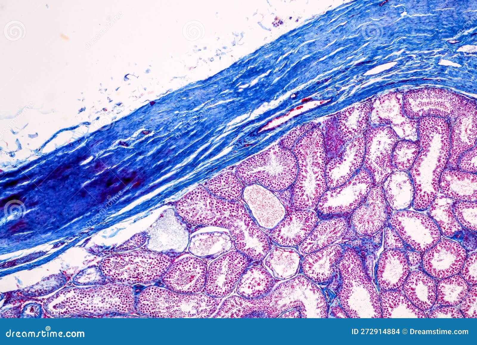 Histological Epididymis and Testis Human Cells Under Microscope. Stock ...