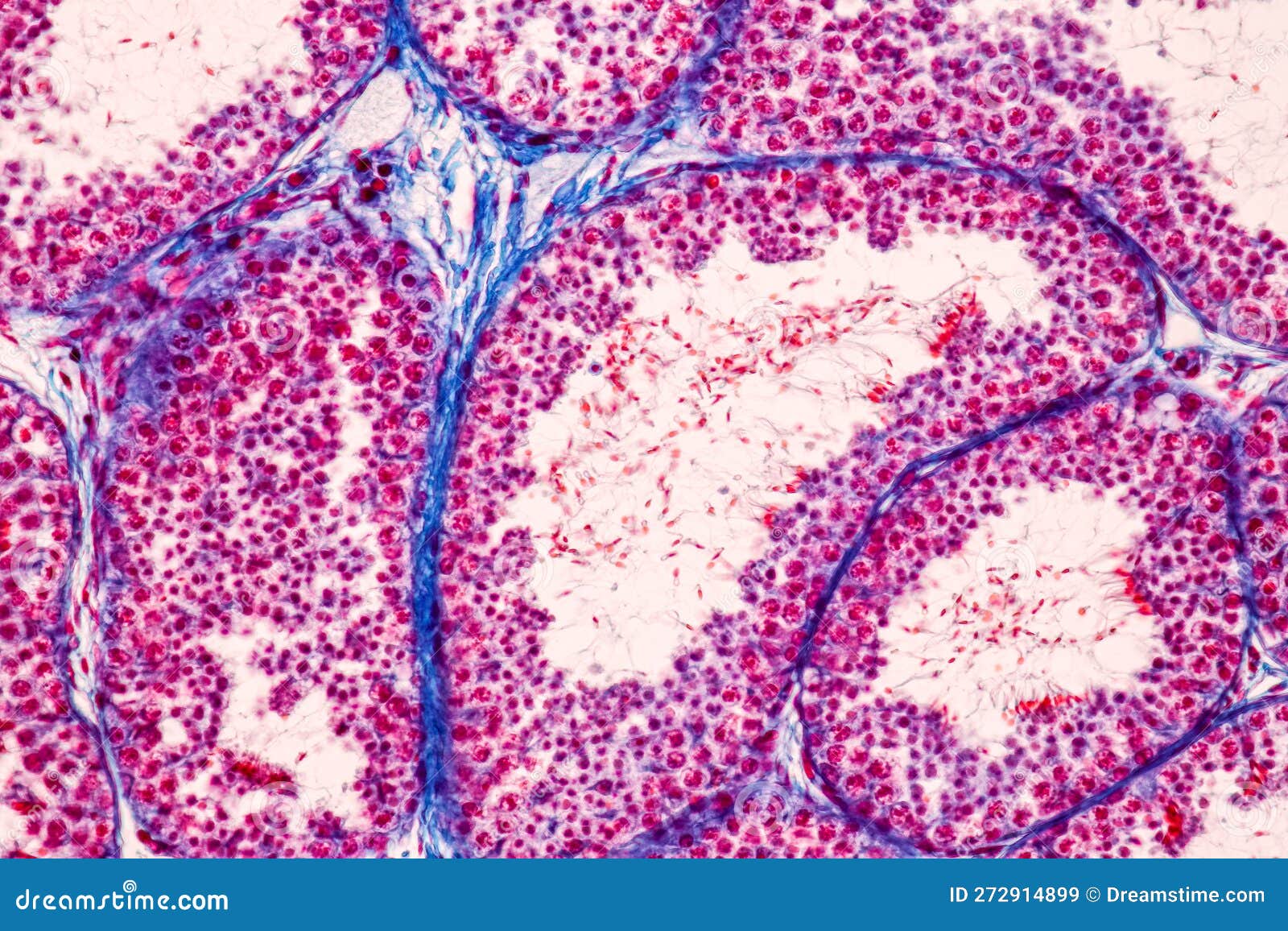 Histological Epididymis and Testis Human Cells Under Microscope. Stock ...