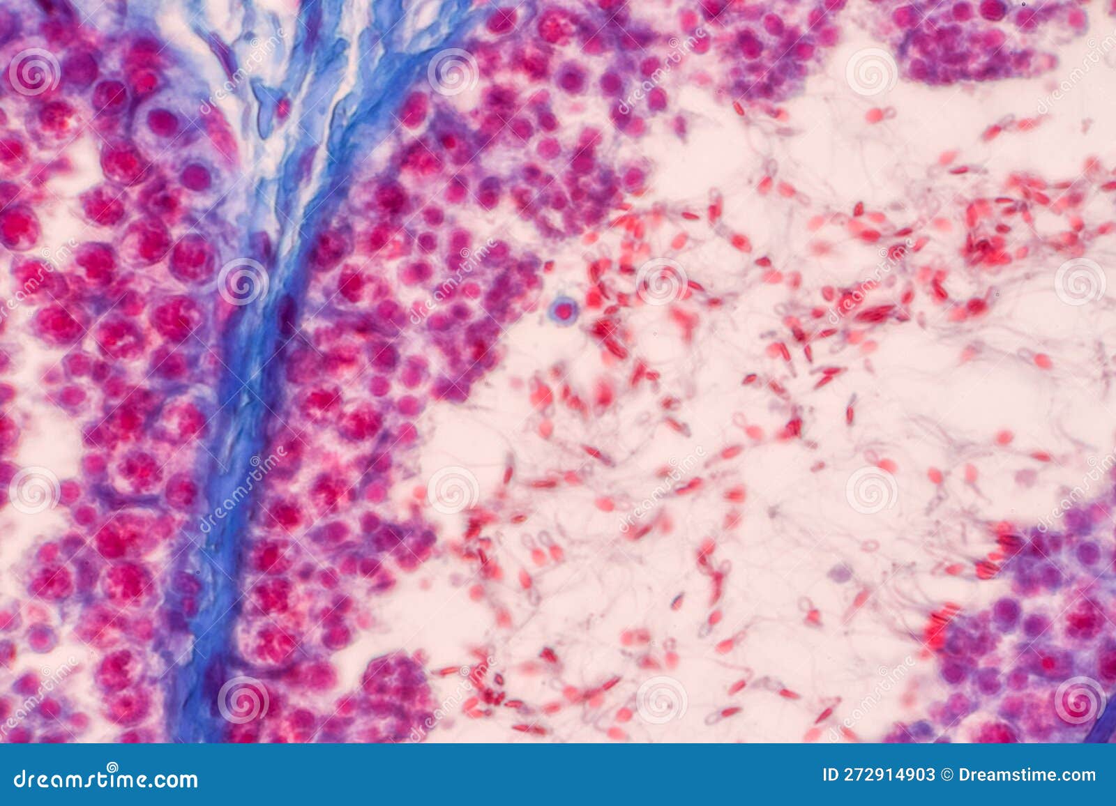 Histological Epididymis and Testis Human Cells Under Microscope. Stock ...