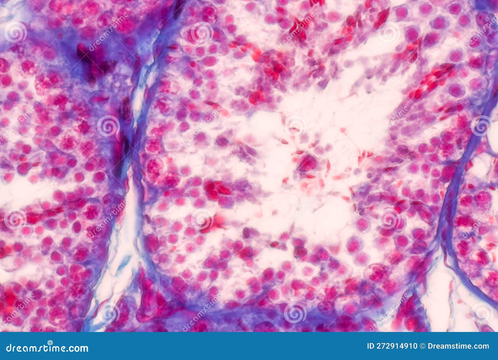 Histological Epididymis and Testis Human Cells Under Microscope. Stock ...