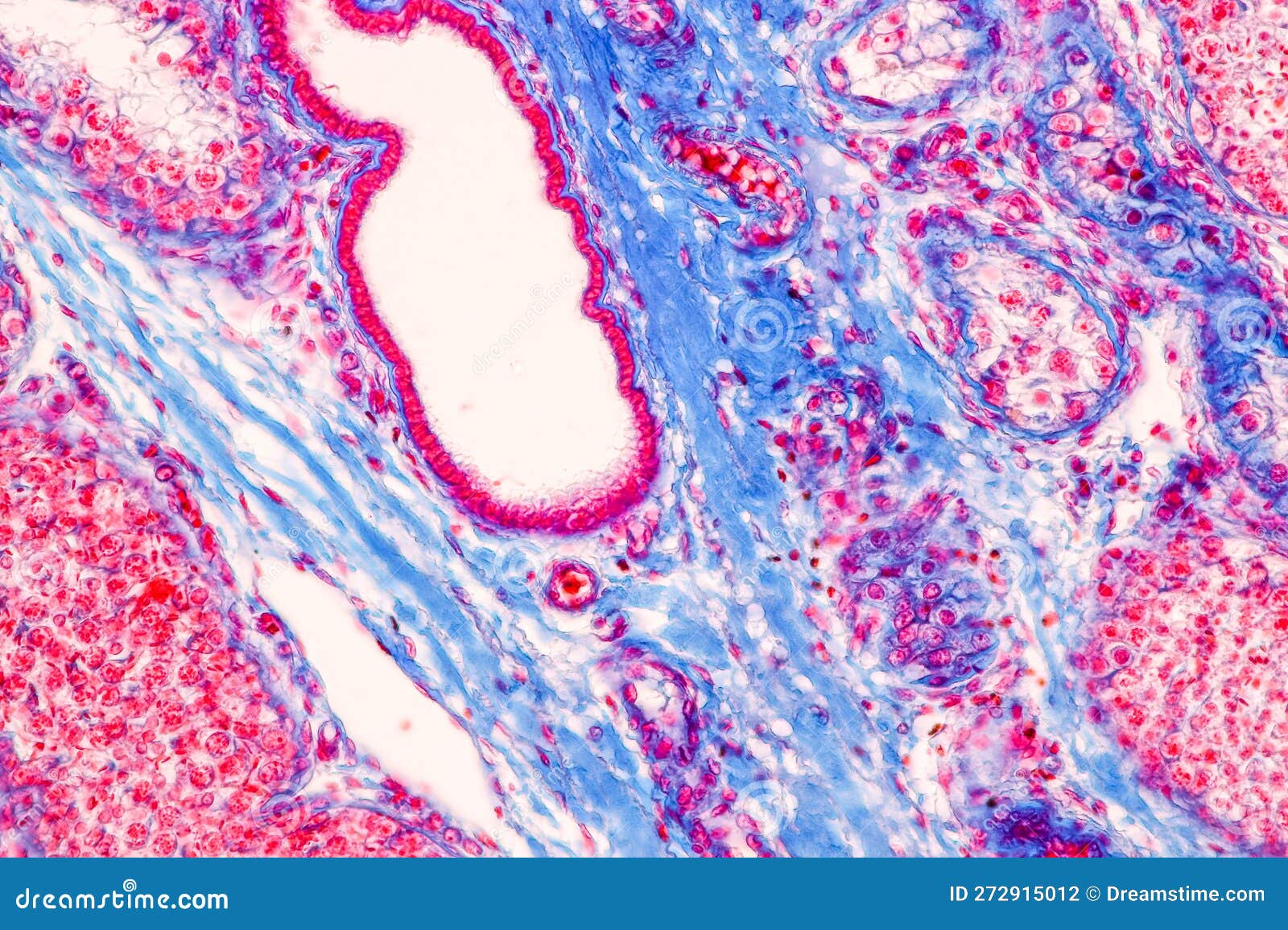 Histological Epididymis and Testis Human Cells Under Microscope. Stock ...