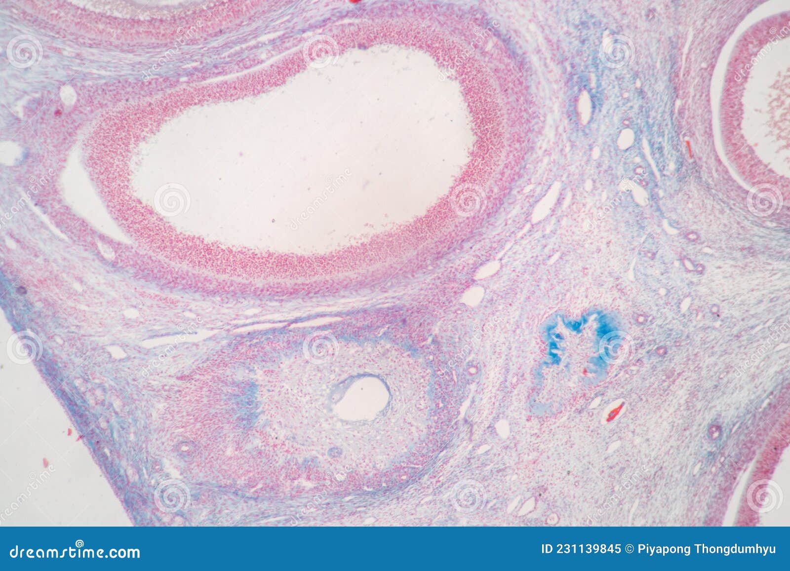 Ovary and Testis Human Cells Under Microscope. Stock Image - Image of ...