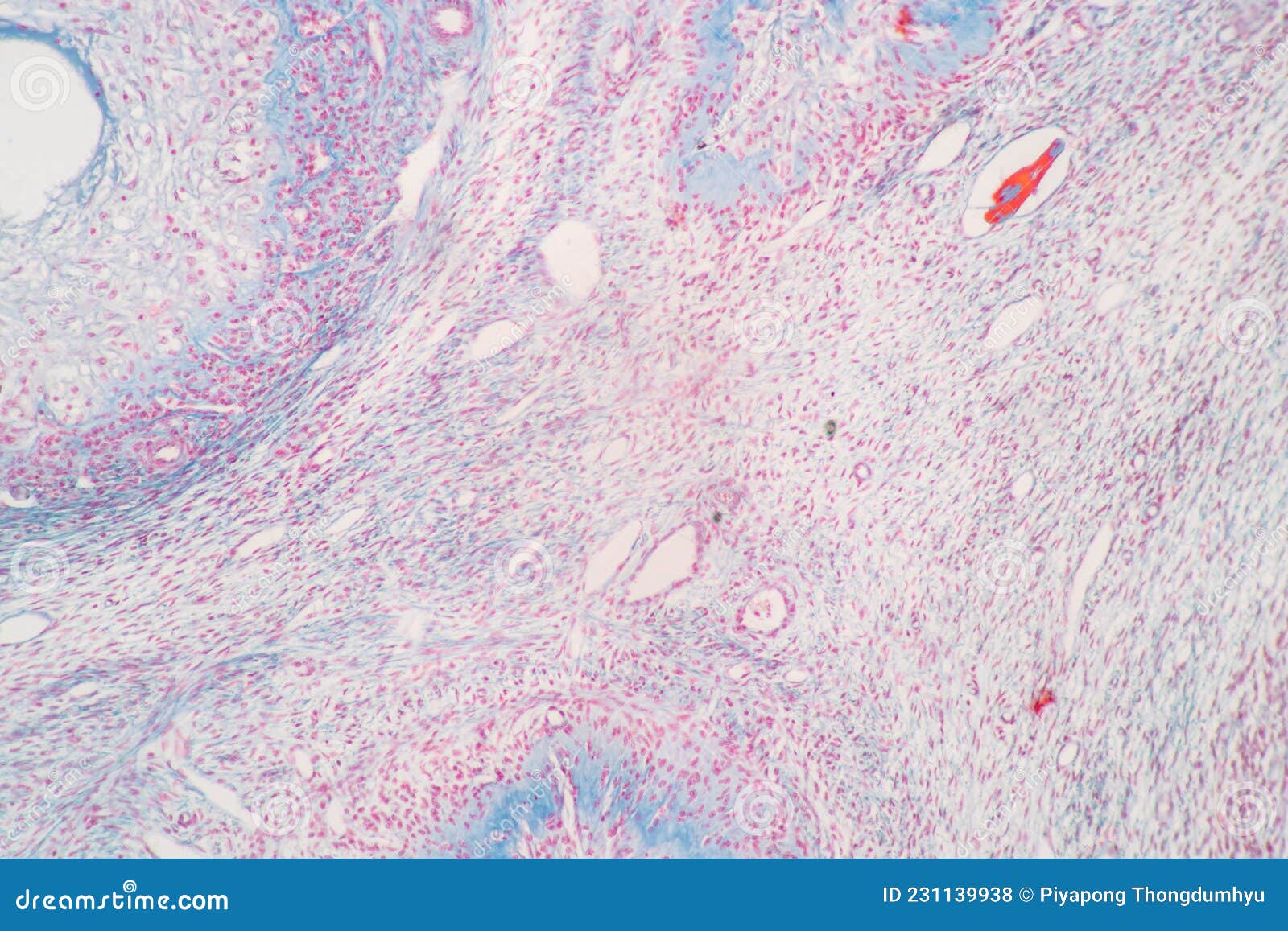 Ovary and Testis Human Cells Under Microscope. Stock Photo - Image of ...
