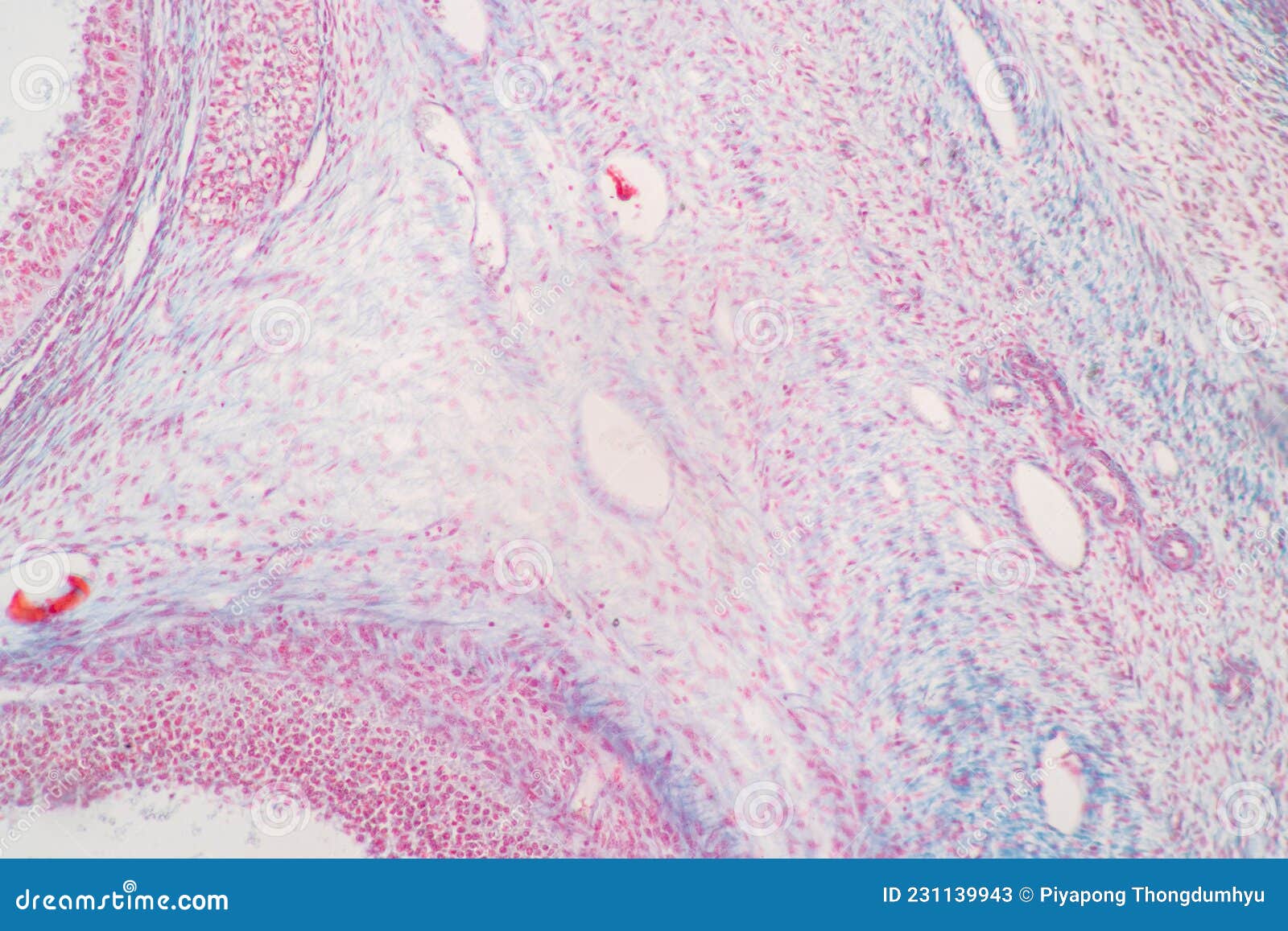Ovary and Testis Human Cells Under Microscope. Stock Image - Image of ...