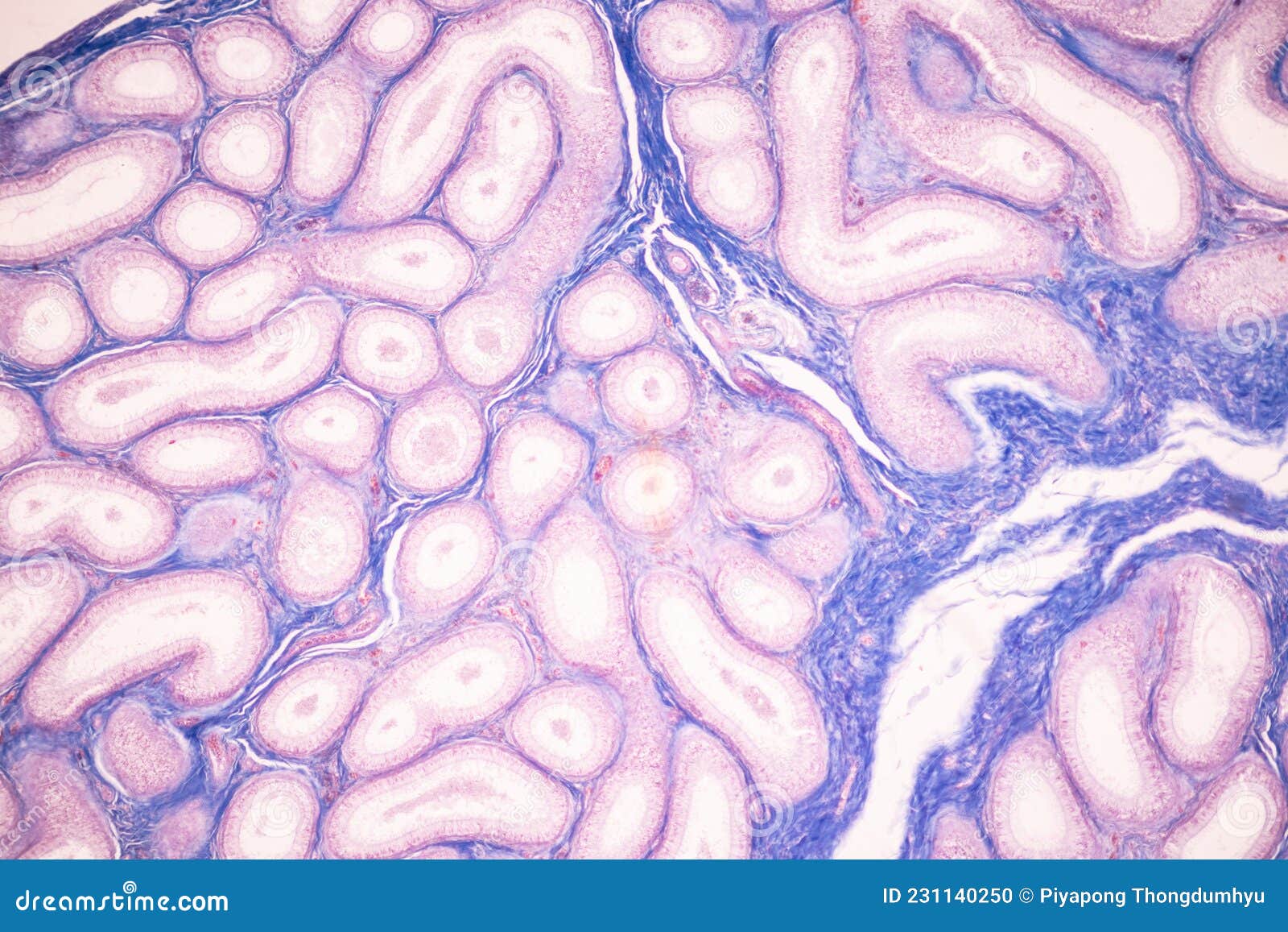 Ovary and Testis Human Cells Under Microscope. Stock Photo - Image of ...
