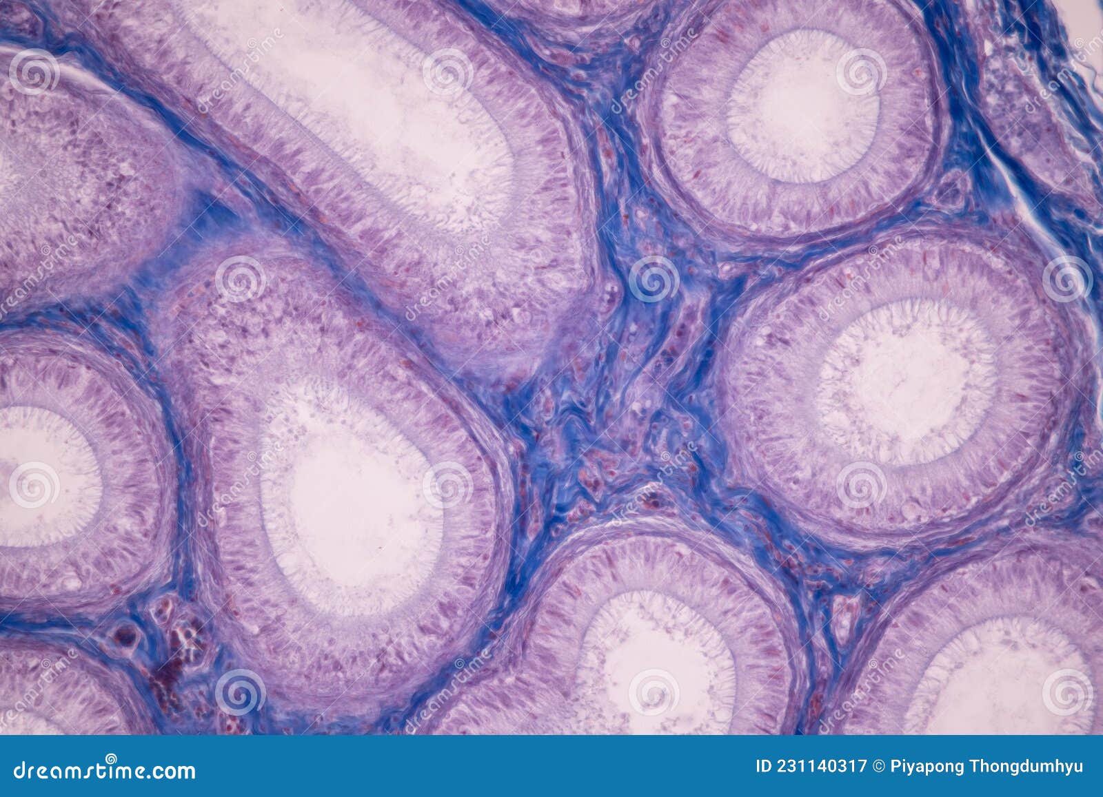 Ovary And Testis Human Cells Under Microscope. Stock Image ...