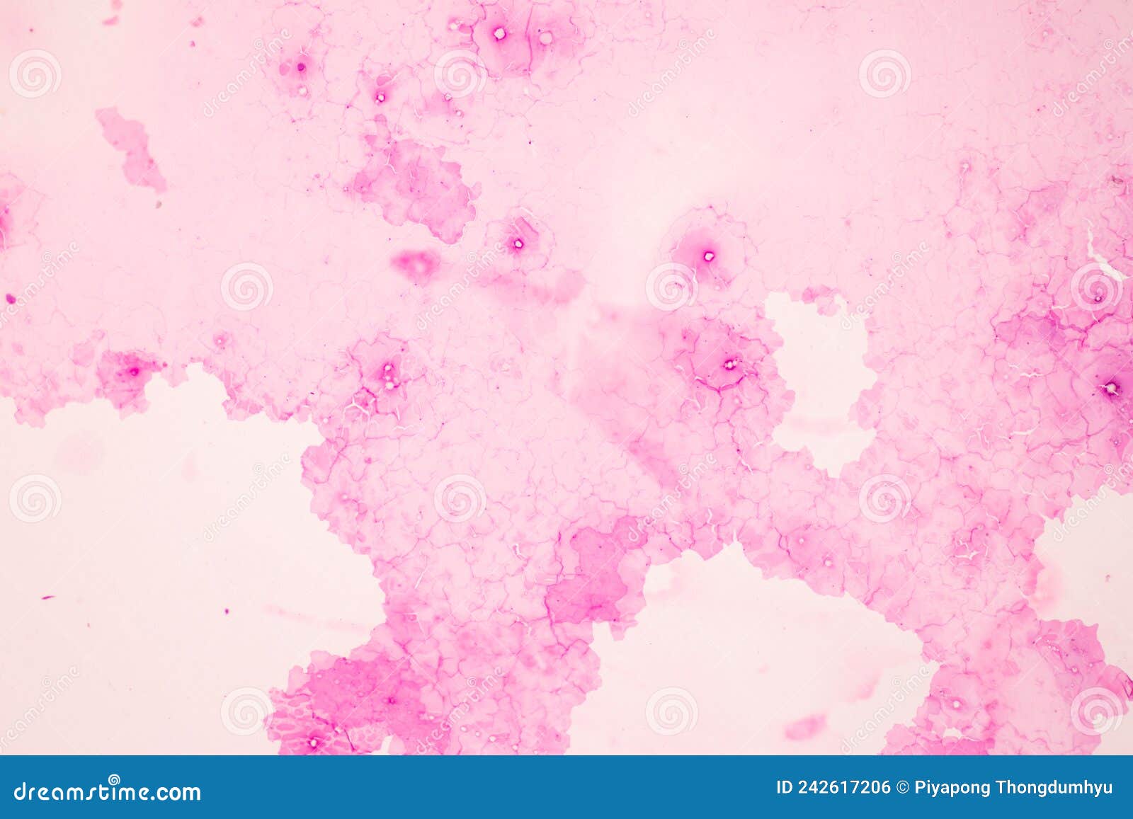Histological Ovary, Testis and Sperm Human Cells Under Microscope ...