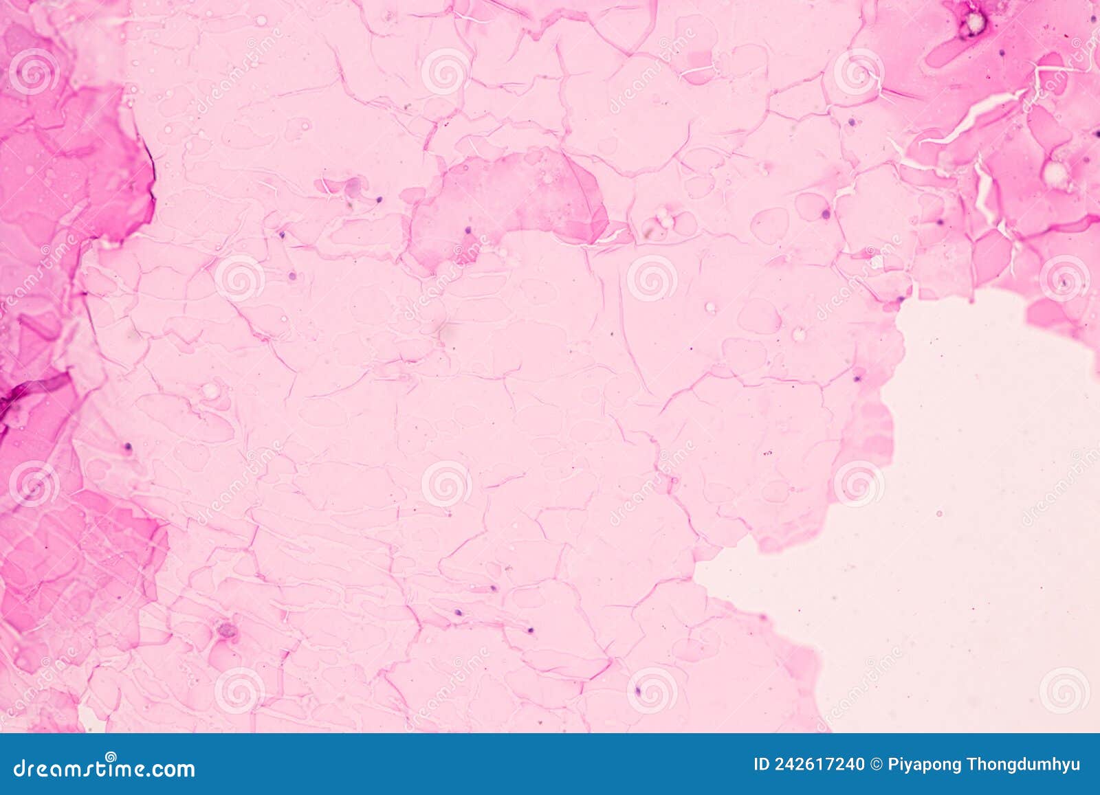 Histological Ovary, Testis and Sperm Human Cells Under Microscope ...