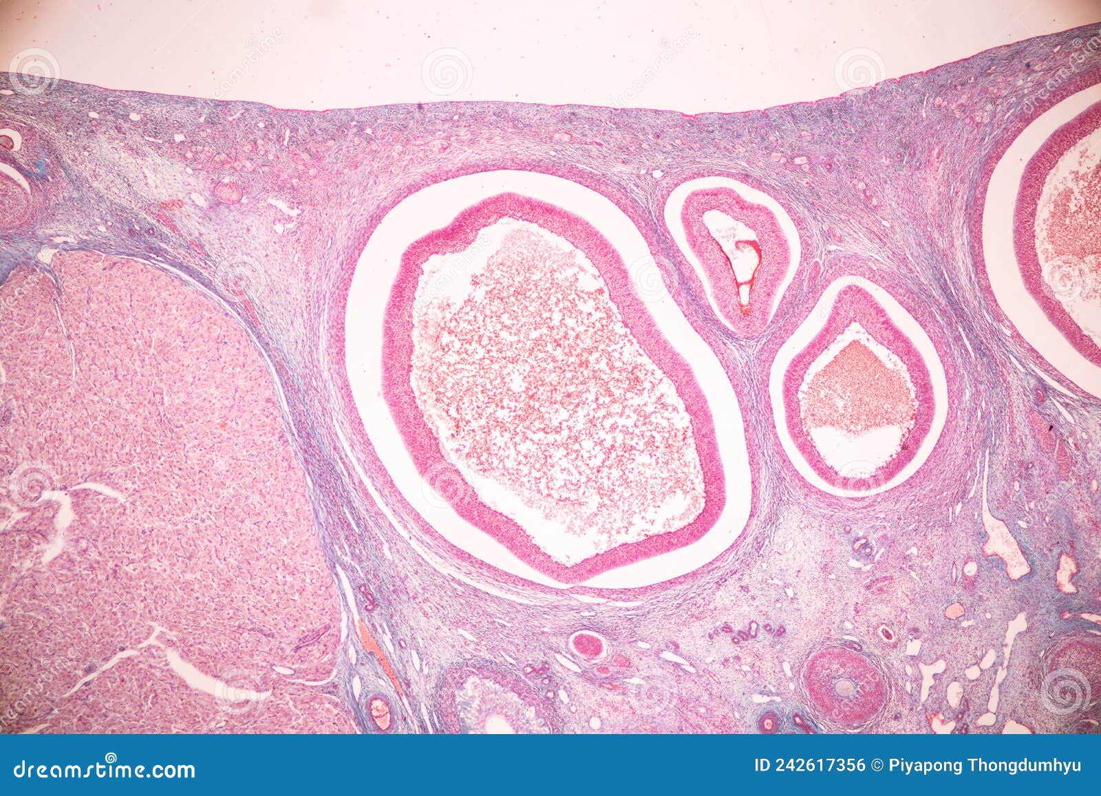 Histological Ovary Testis And Sperm Human Cells Under Microscope