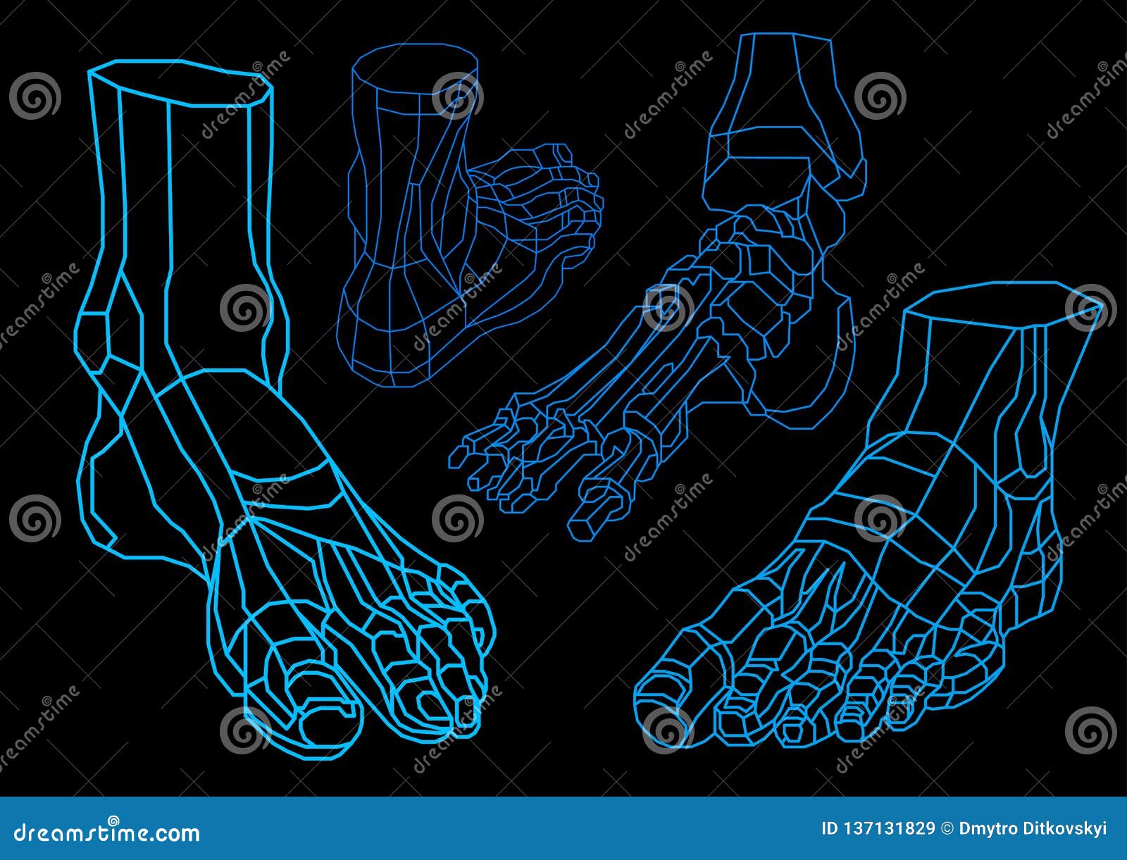 Legs And Angles Of The Knees, Different Types Of Leg Shapes. Normal ...