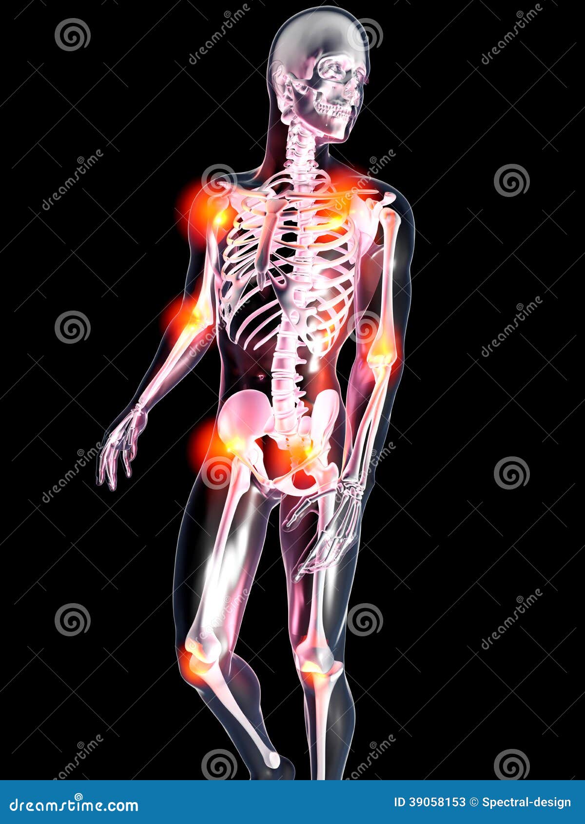 Anatomy - Painful Joints stock illustration. Illustration of care ...