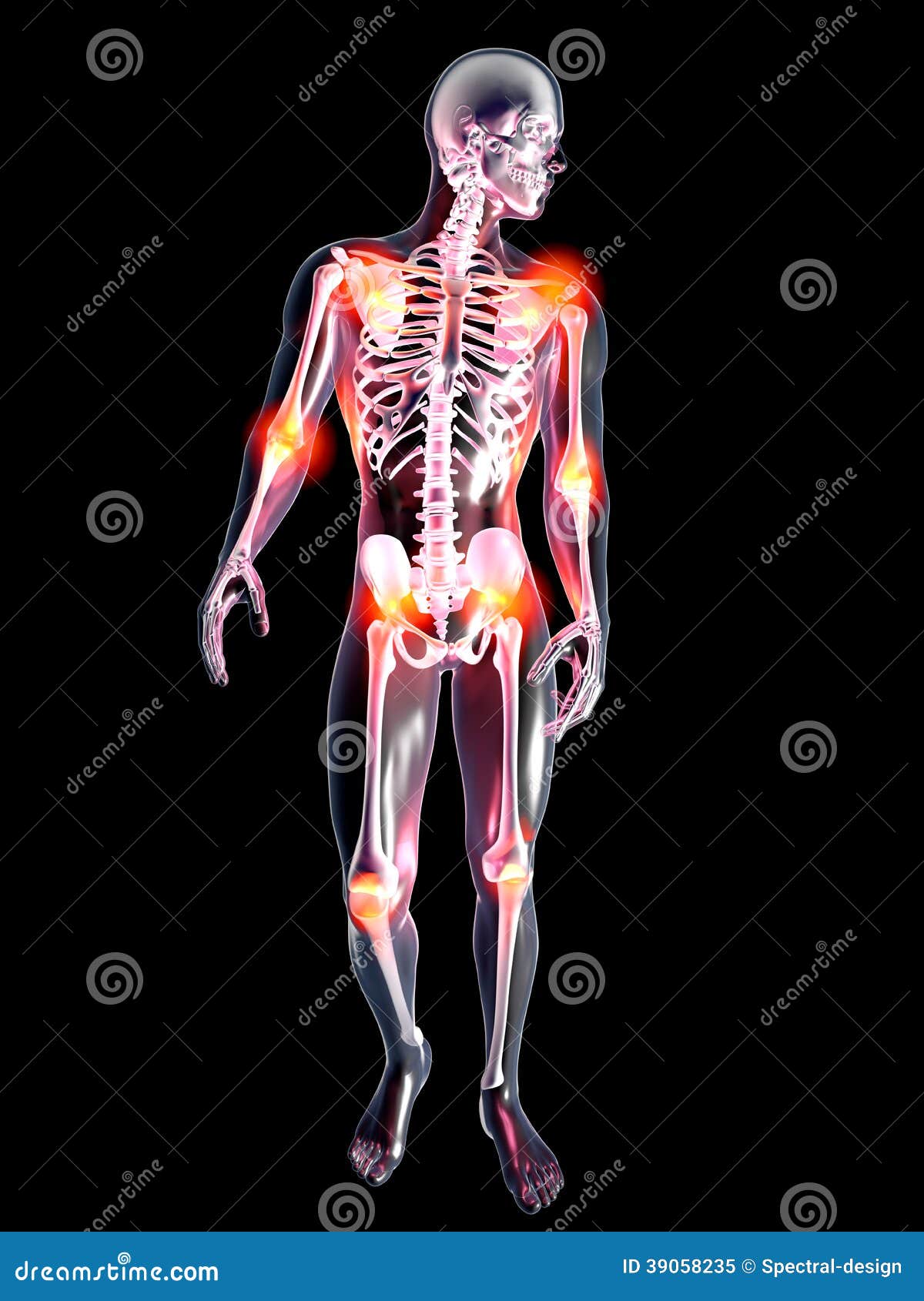Anatomy - Painful Joints stock illustration. Illustration of disease ...