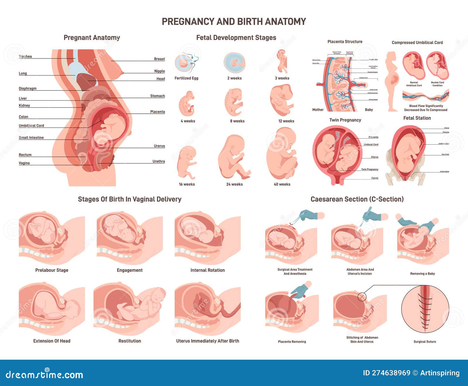 Placenta Anatomy. Human Fetus Oxygen And Nutrients Supplying Cartoon ... Placenta Anatomy. Human Fetus Oxygen And Nutrients Supplying Cartoon ...