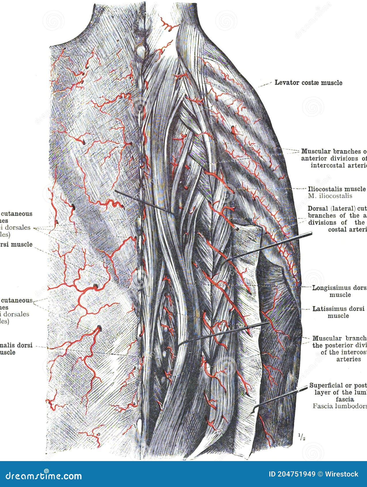 Cta Brachial Artery Or Ct Scan Vessel Of Upper Extremity Stock Image