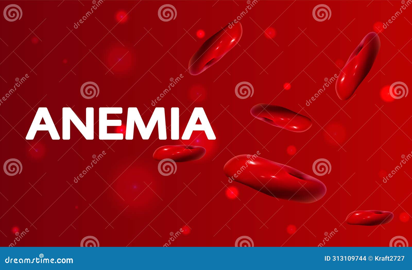 Anemia Red Blood Cells Royalty-Free Cartoon | CartoonDealer.com #369917117