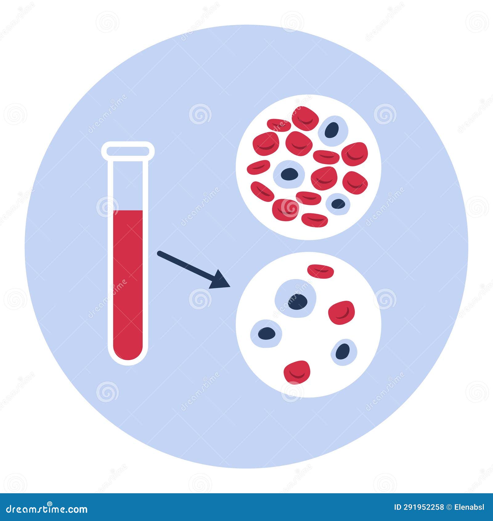 Anemia: Blood Test Samples Comparison Stock Illustration - Illustration ...