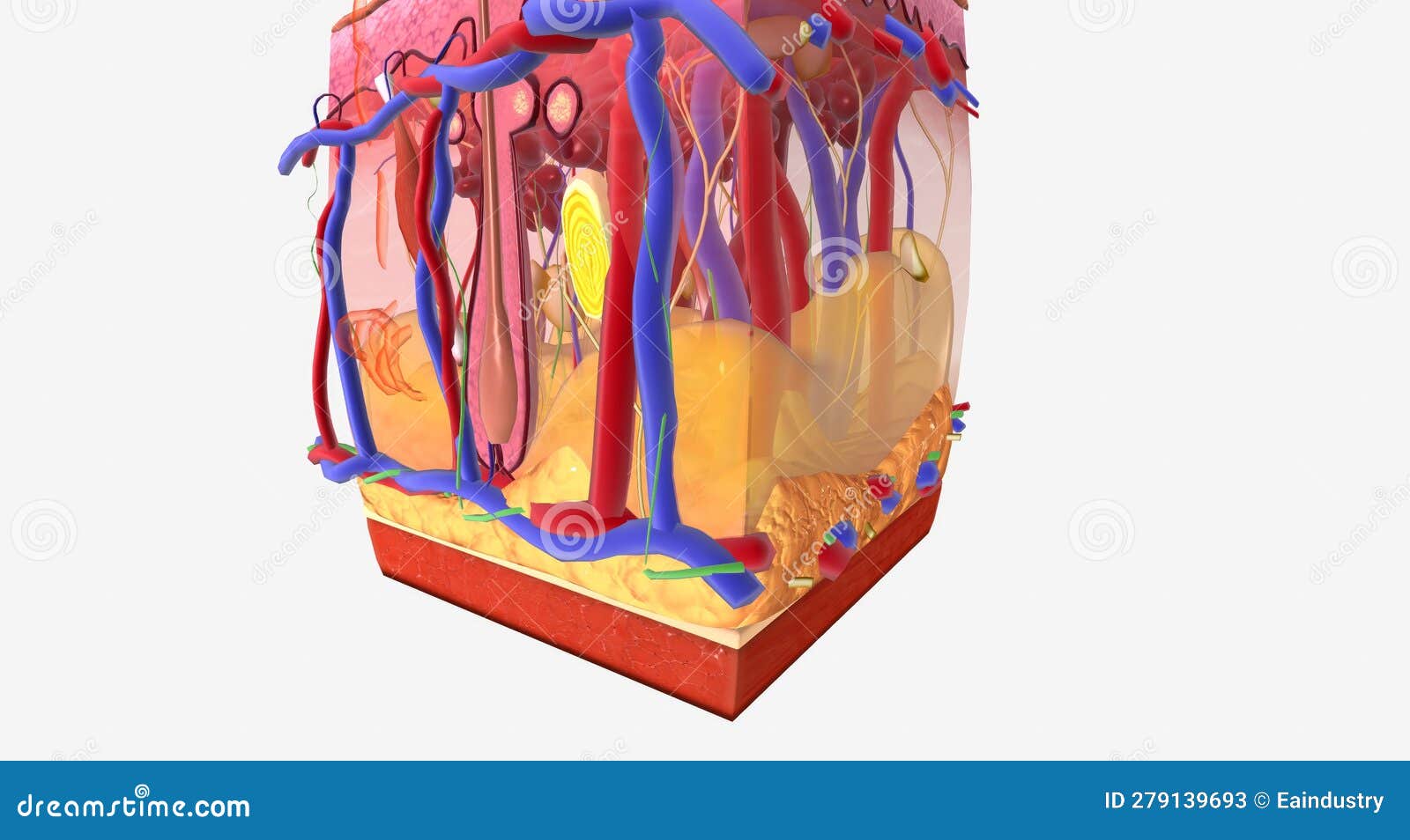 Angioedema is a Swelling of the Dermis and Subcutaneous Tissue Stock ...