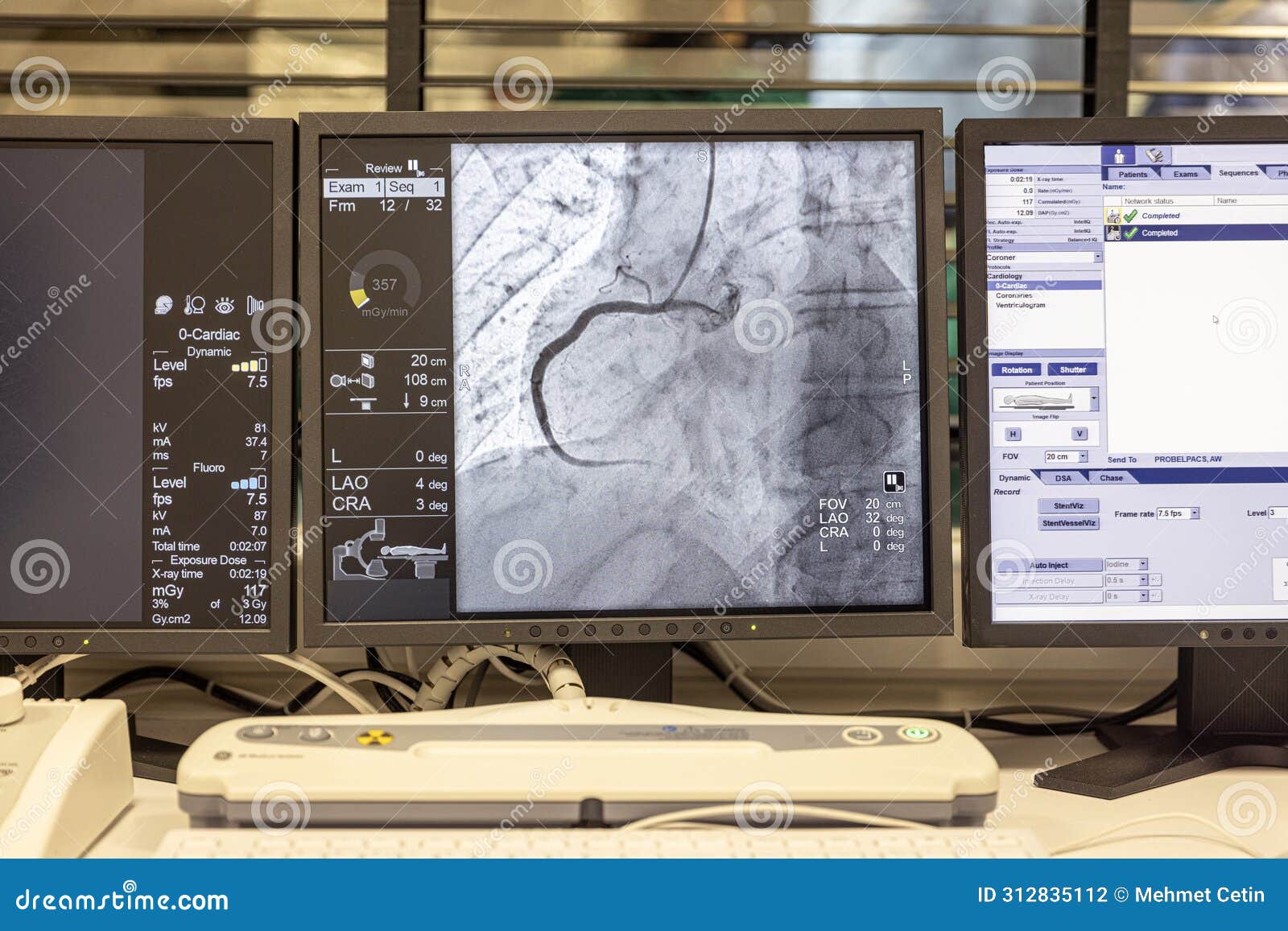 Angiogram Sequence Working Clockwise Using X-rays with a Contrast Agent ...