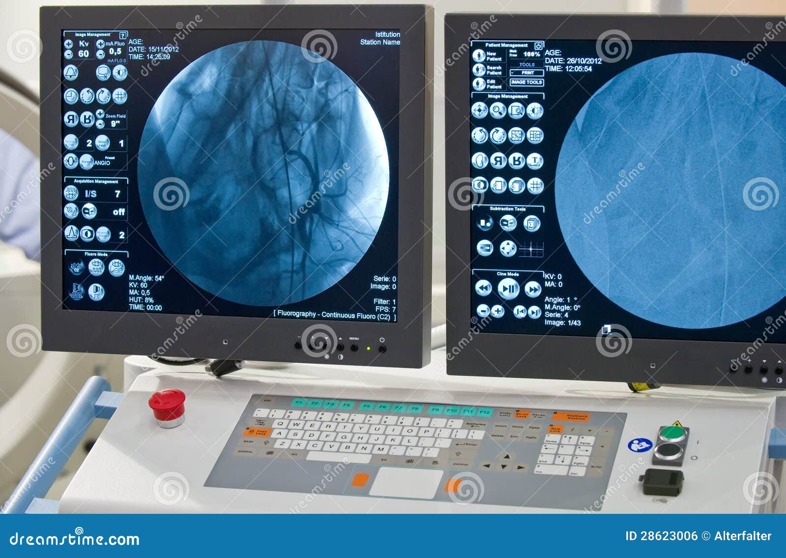 Angiography stock photo. Image of body, blood, apparatus - 28623006