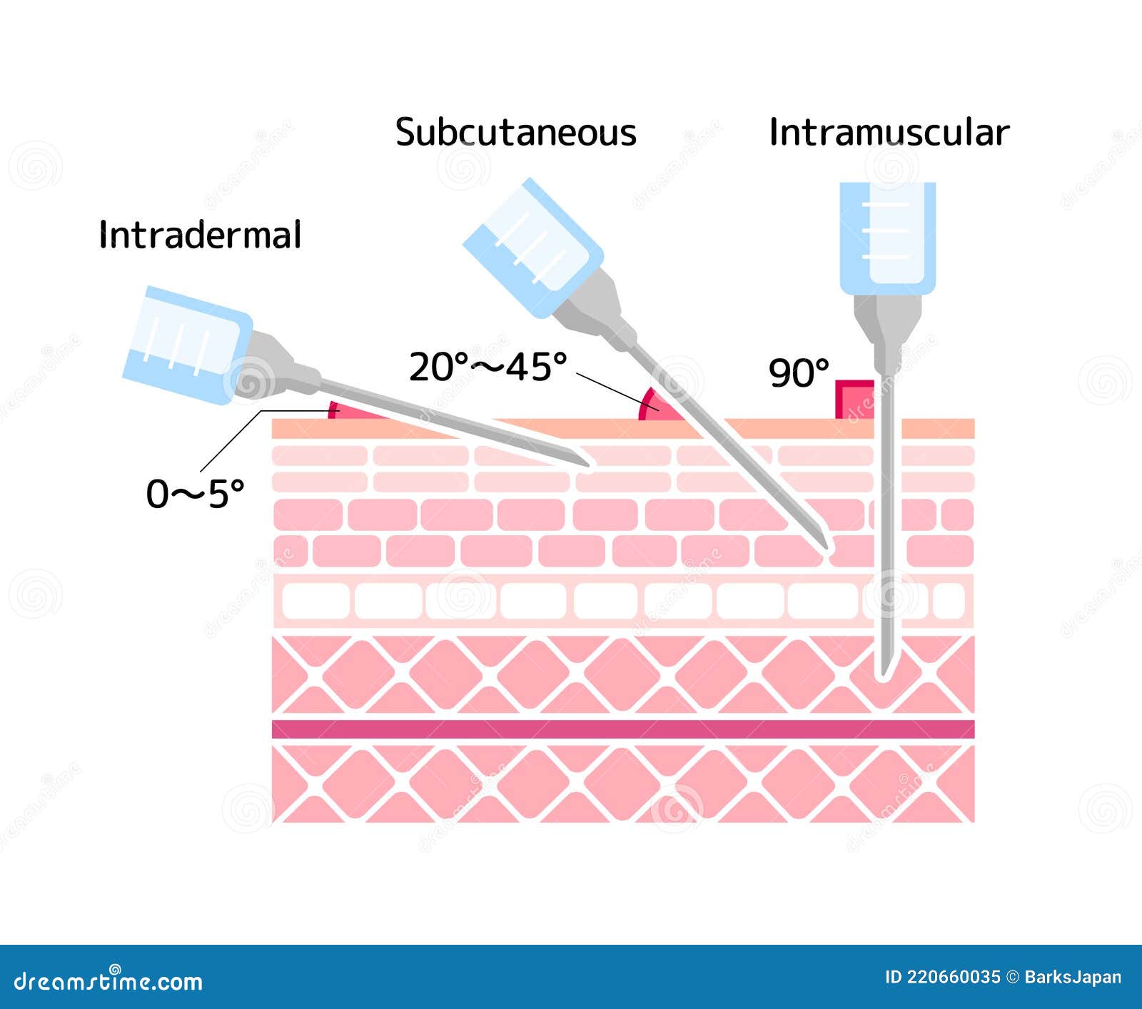 90 Degree Angle Injection