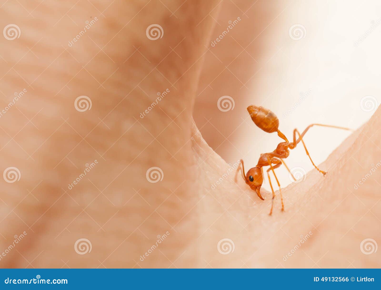 Angry Ant Attack by Bite and Spray Citric Acid Stock Photo - Image of ...